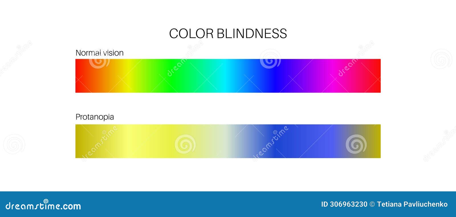 Protanopia Red Color Blindness Daltonism Ishihara Test Number Cartoon ...