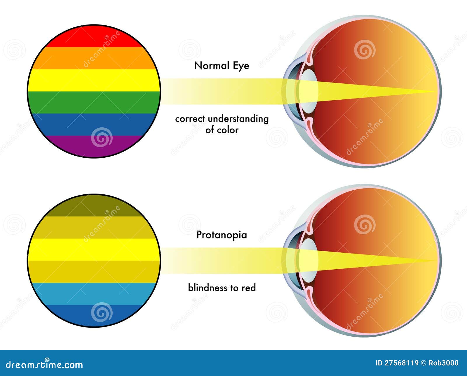 Protanopie Images libres de droits - Image: 27568119