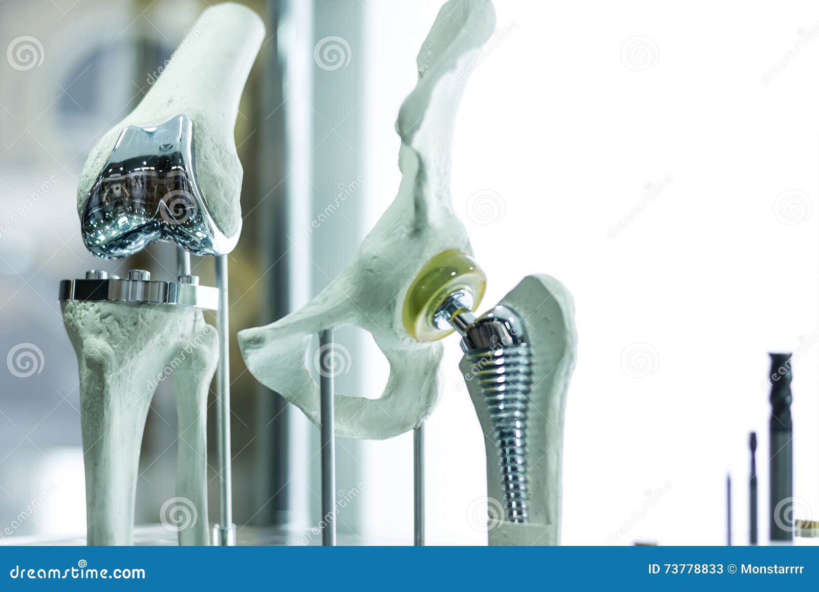 Protesi Dell'anca E Del Ginocchio Immagine Stock - Immagine di cerniera ...