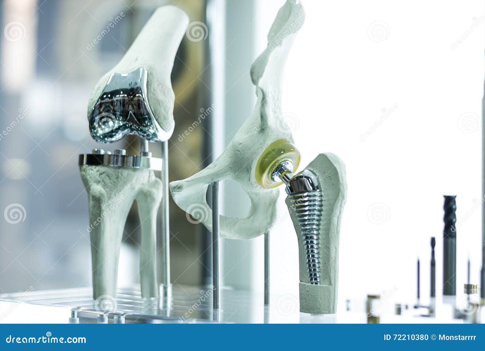 Protesi Dell'anca E Del Ginocchio Per Medicina Fotografia Stock ...