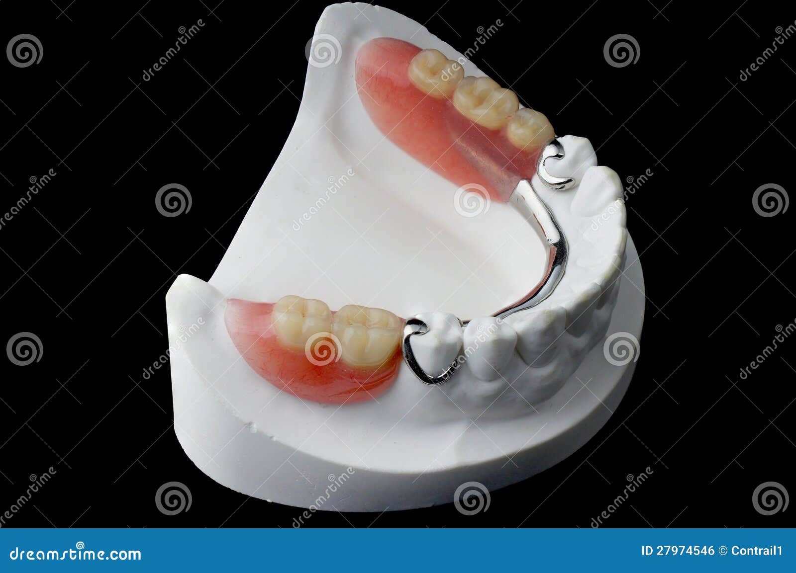 Protesi dentaria fotografia stock. Immagine di cura, medicina - 27974546