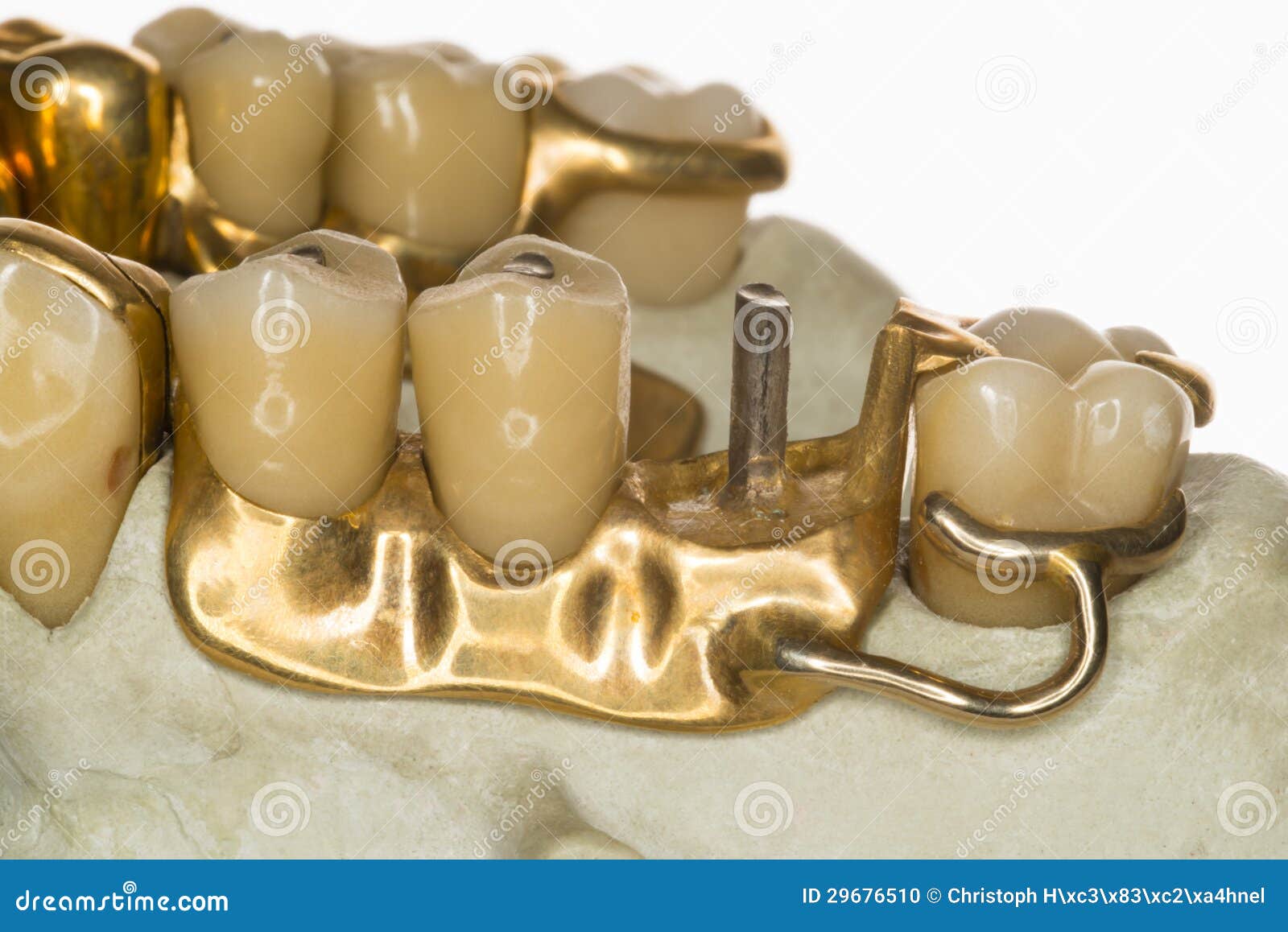 Protesi Dentaria (circa 1950) Fotografia Stock - Immagine di dente ...