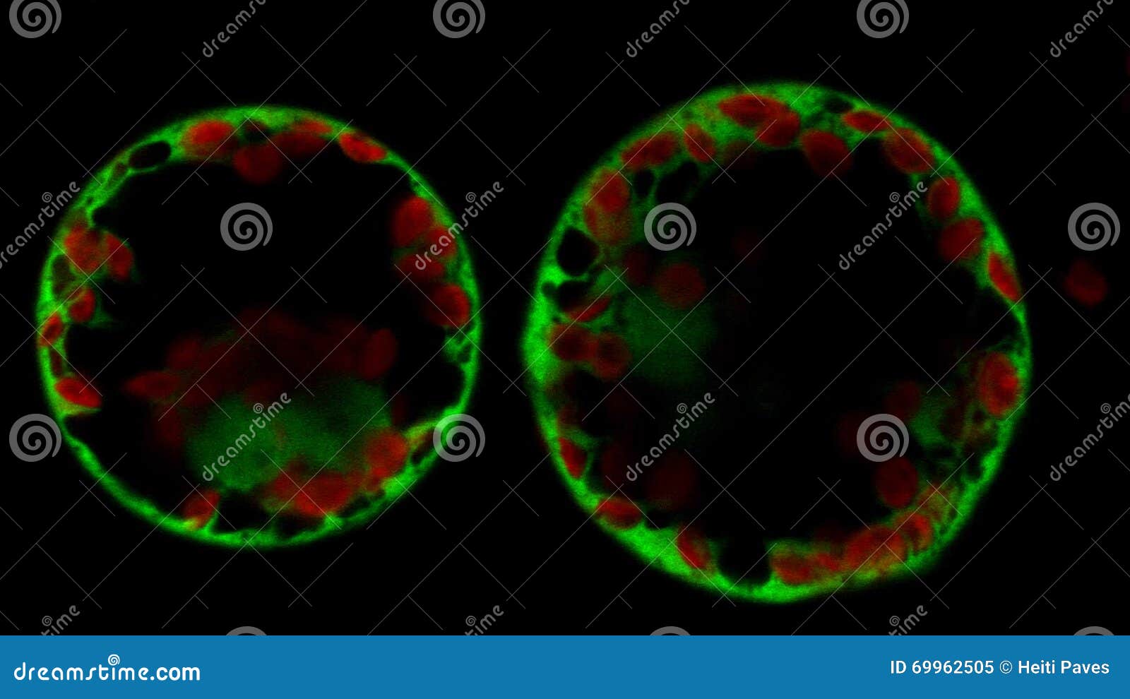 Protoplasts stock video. Video of cells, chloroplasts - 69962505