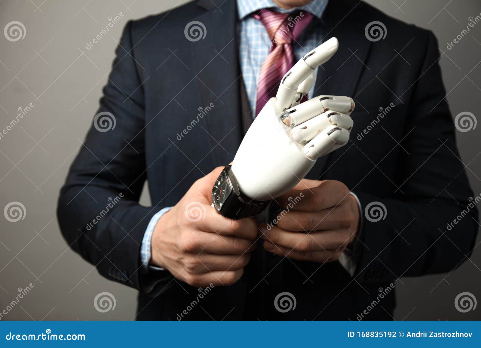 Prototype Bionic Prosthesis in Hands of Businessman. Restoration and ...