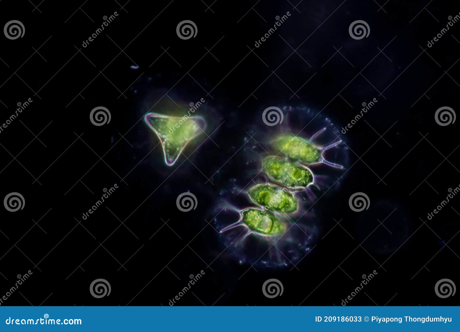 Protozoa and Green Algae in Waste Water Under the Microscope. Stock ...