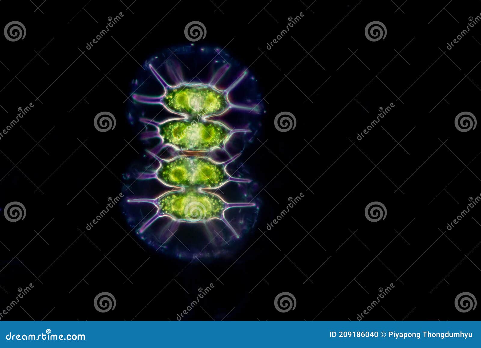 Protozoa and Green Algae in Waste Water Under the Microscope. Stock ...