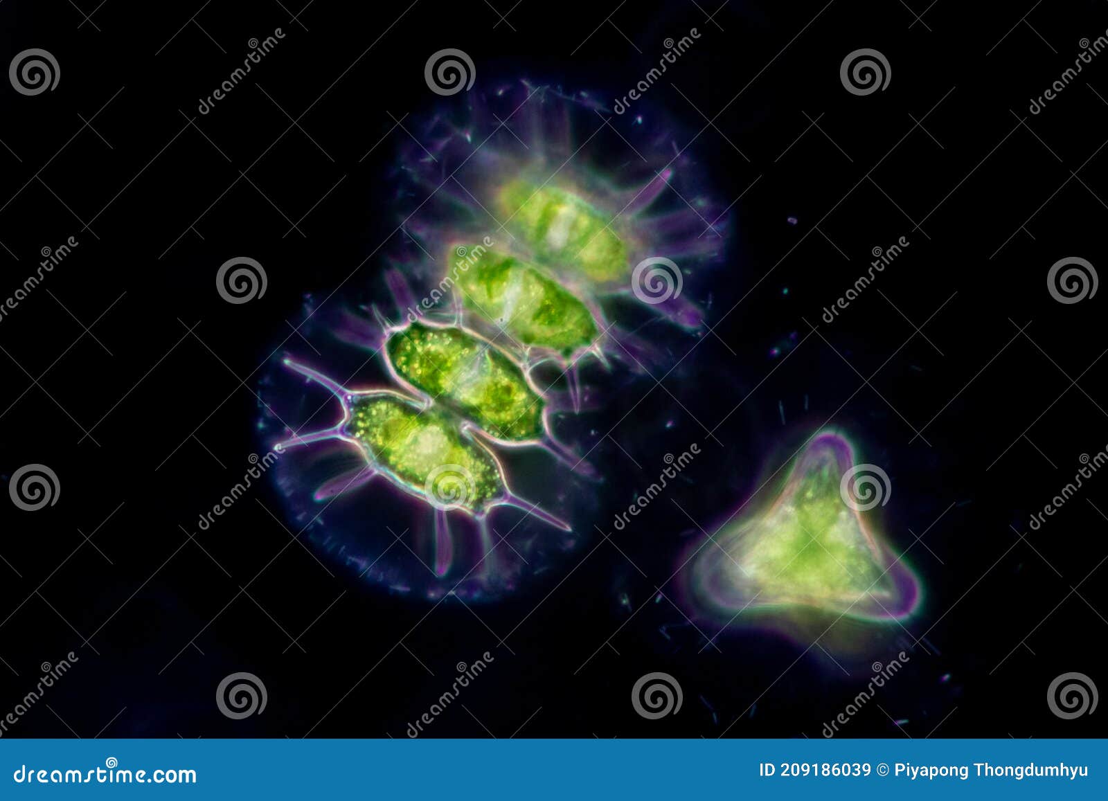 Protozoa And Green Algae In Waste Water Under The Microscope. Royalty ...