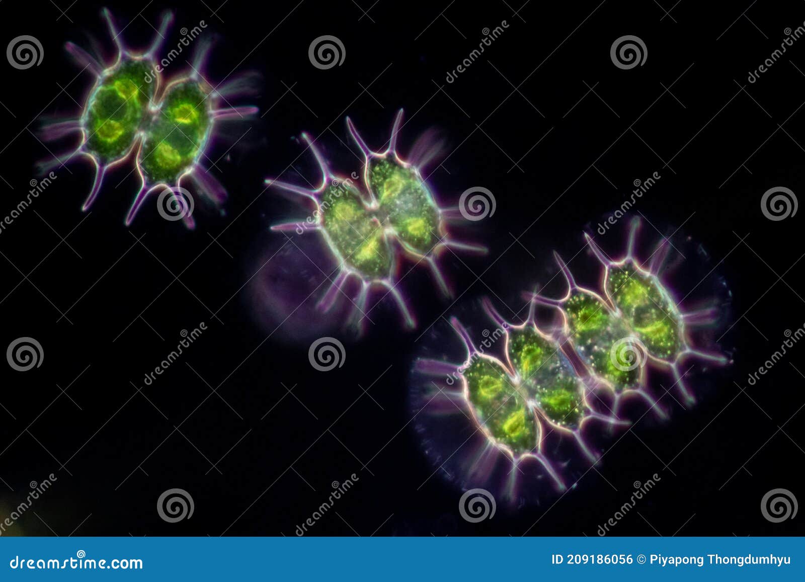 Protozoa and Green Algae in Waste Water Under the Microscope. Stock ...