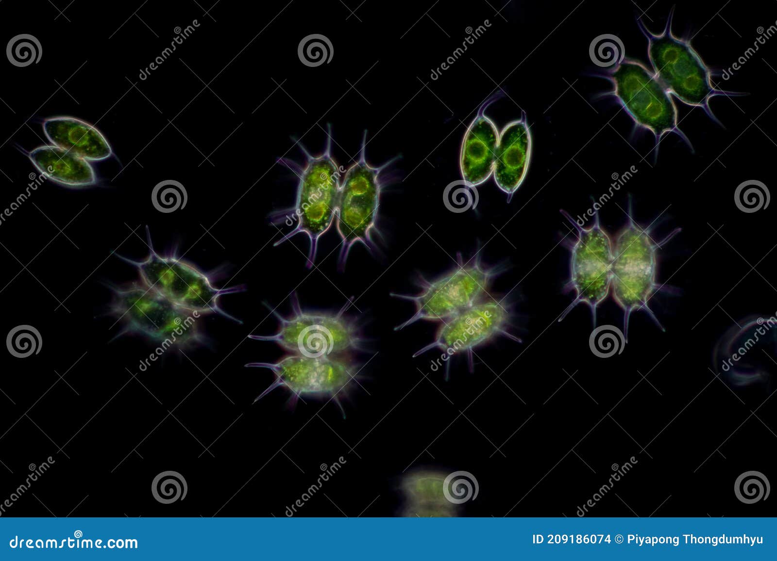 Protozoa and Green Algae in Waste Water Under the Microscope. Stock ...