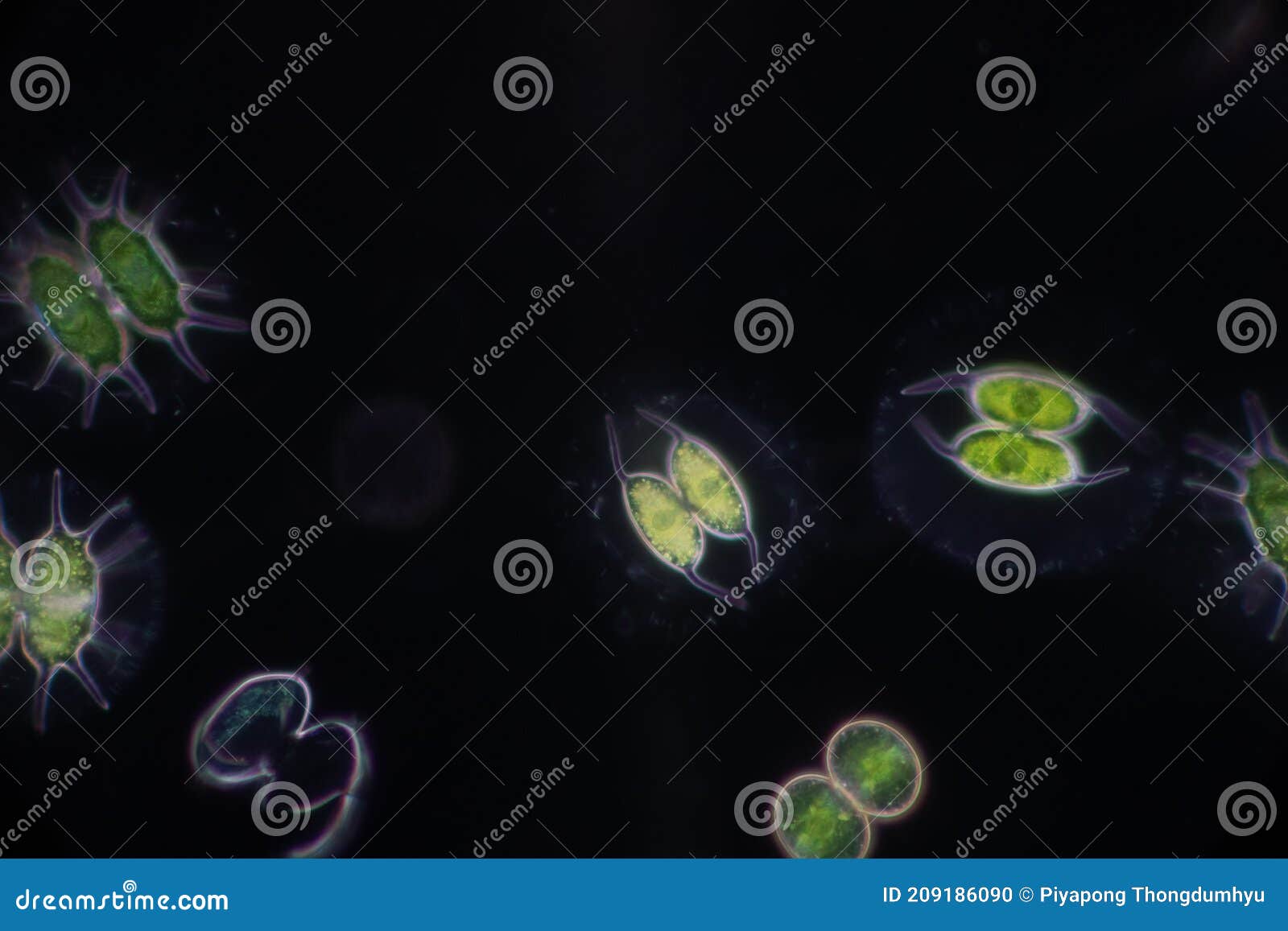 Protozoa and Green Algae in Waste Water Under the Microscope. Stock ...