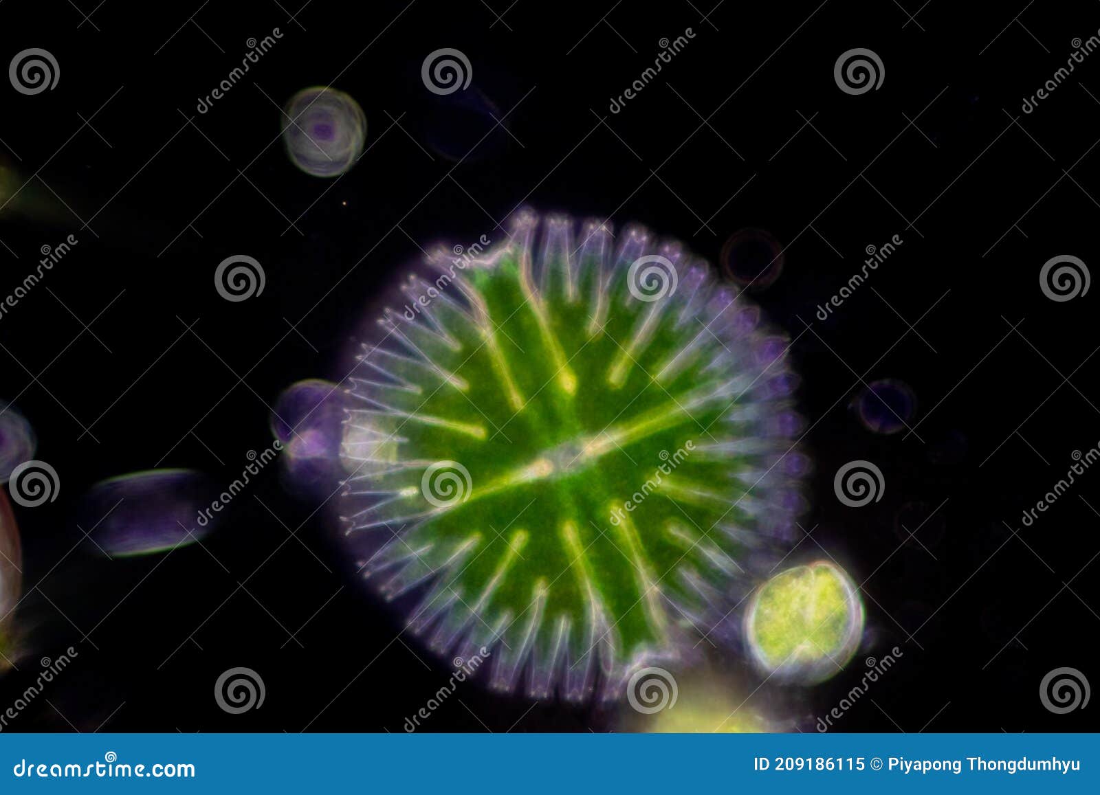 Protozoa and Green Algae in Waste Water Under the Microscope. Stock ...