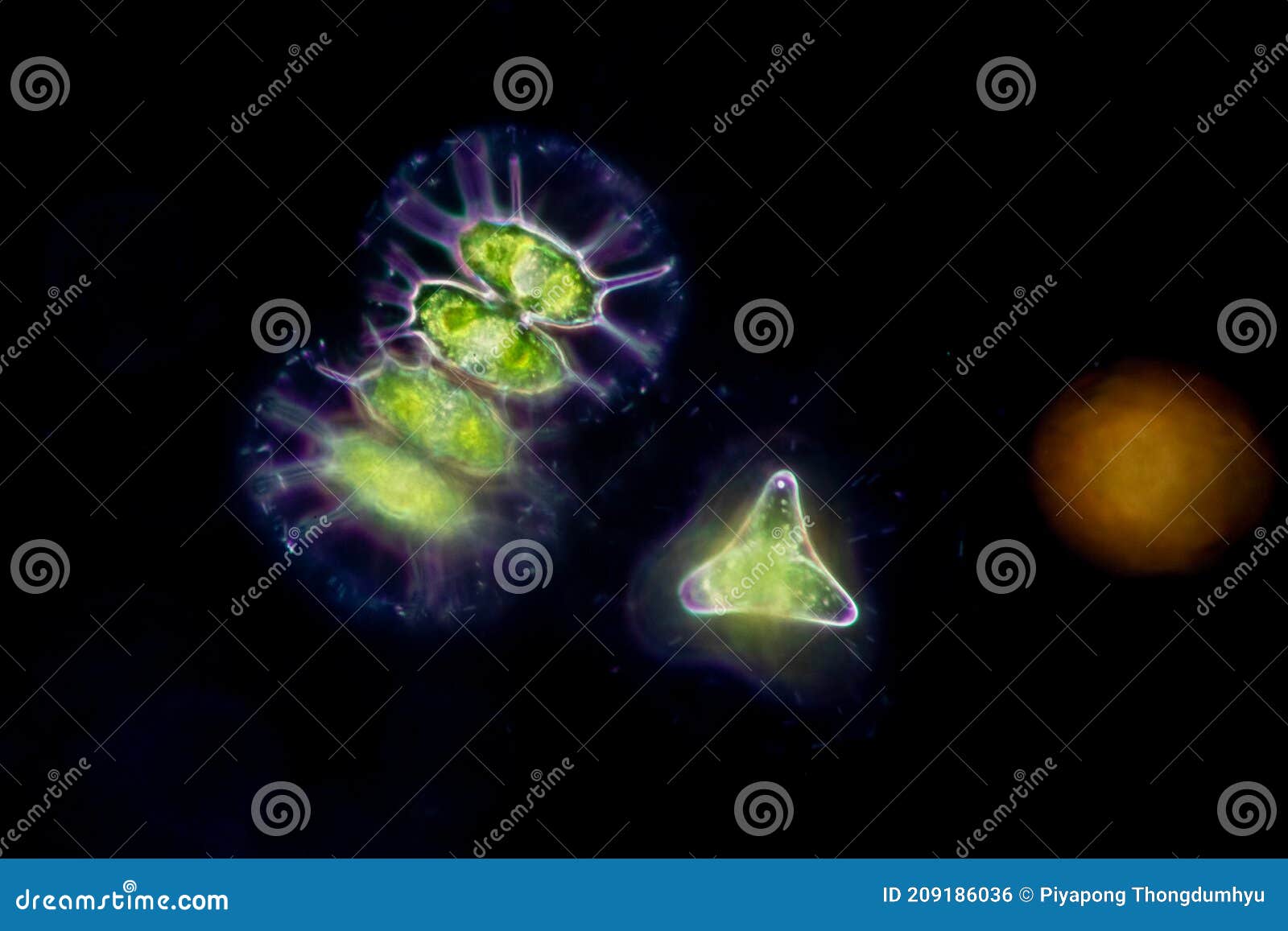 Protozoa and Green Algae in Waste Water Under the Microscope. Stock ...