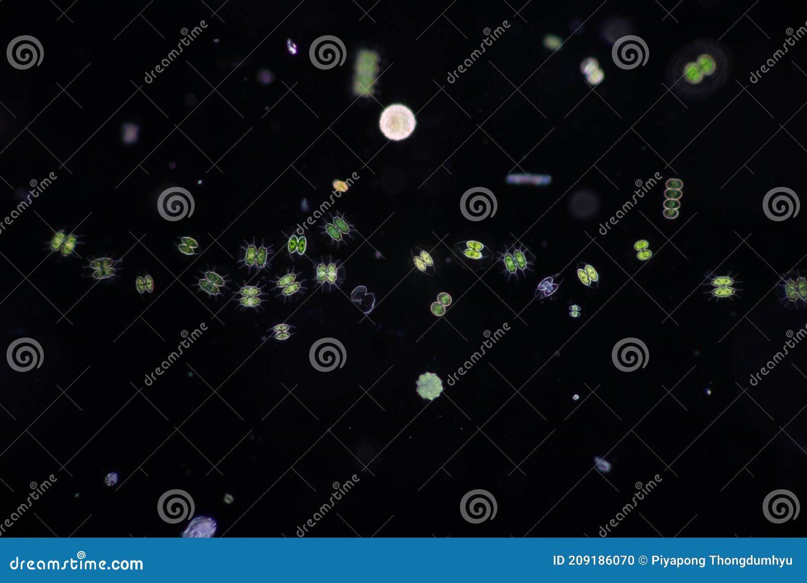 Protozoa and Green Algae in Waste Water Under the Microscope. Stock ...