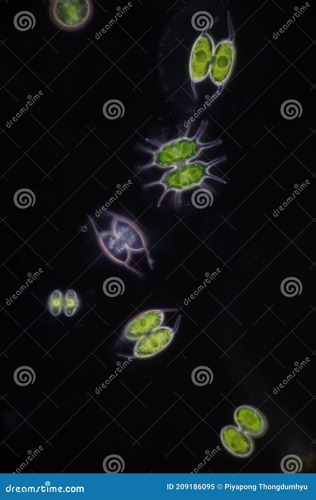 Protozoa and Green Algae in Waste Water Under the Microscope. Stock ...
