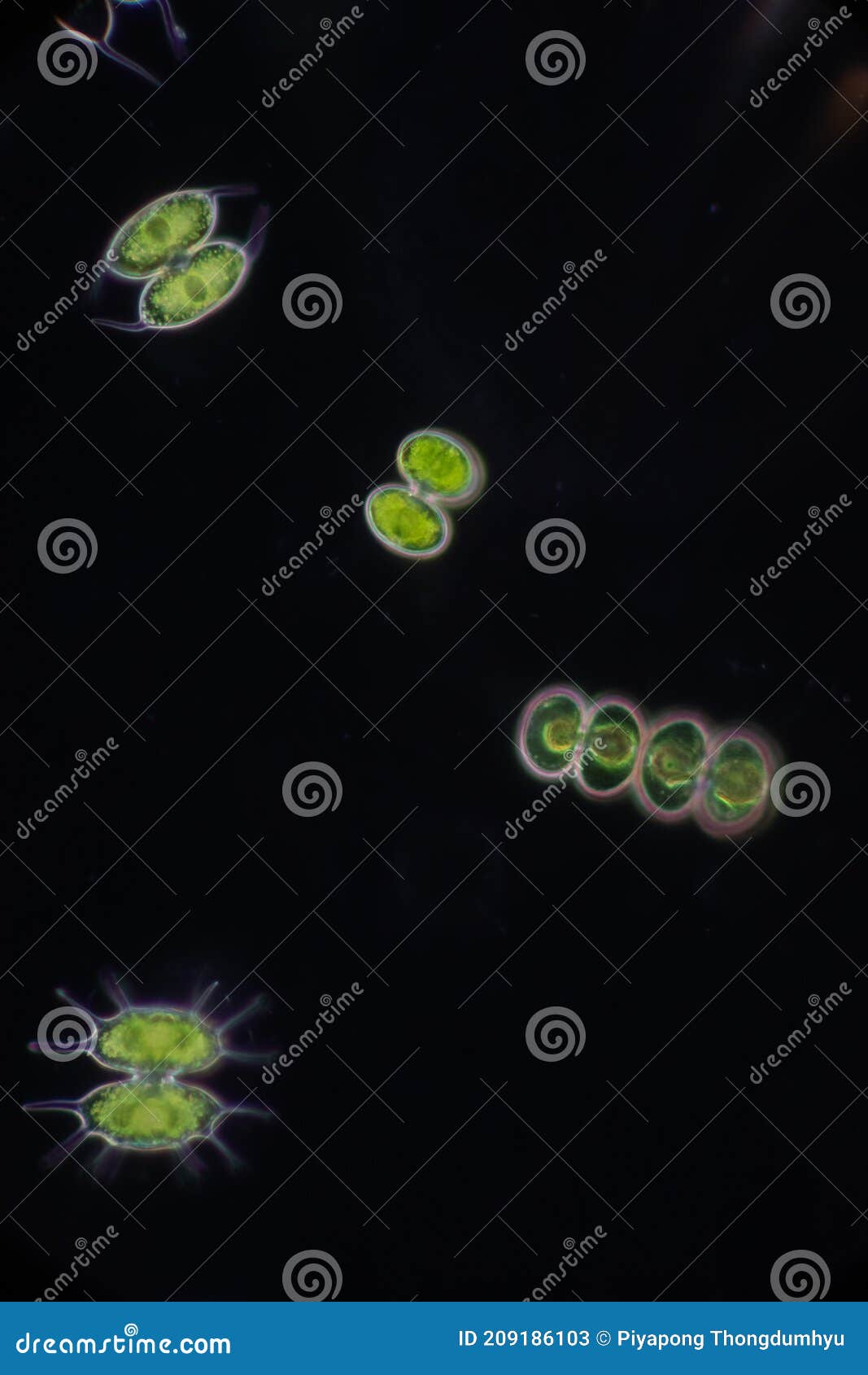 Protozoa And Green Algae In Waste Water Under The Microscope. Stock ...