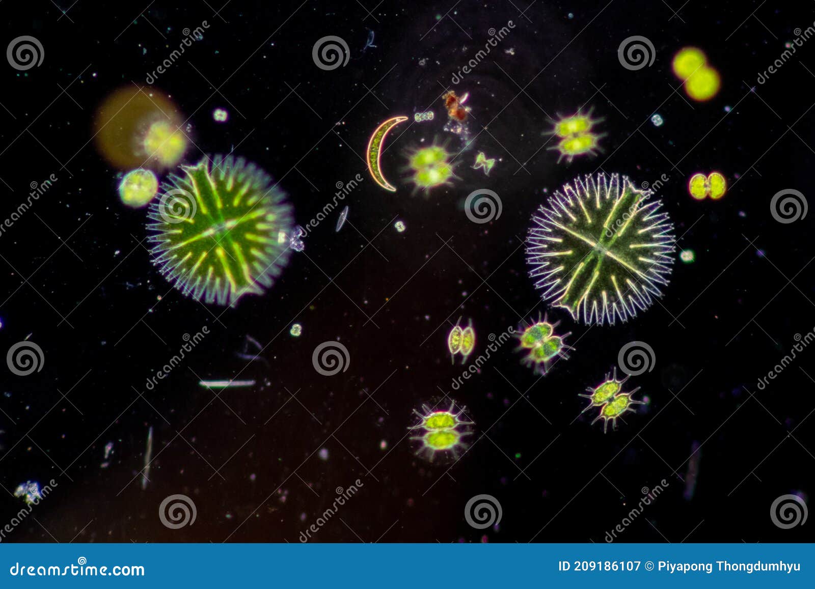 Protozoa and Green Algae in Waste Water Under the Microscope. Stock ...