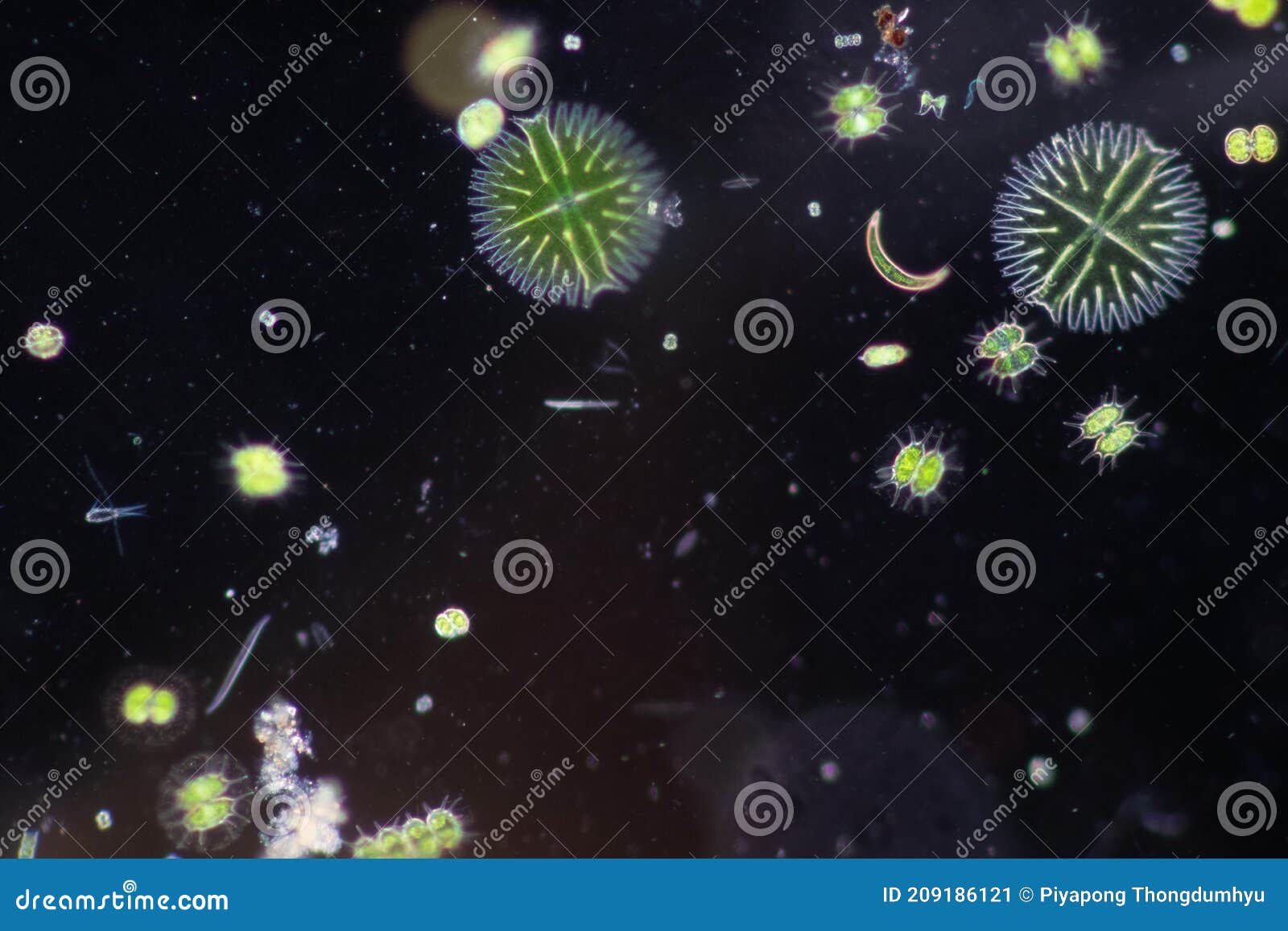 Protozoa And Green Algae In Waste Water Under The Microscope. Stock ...