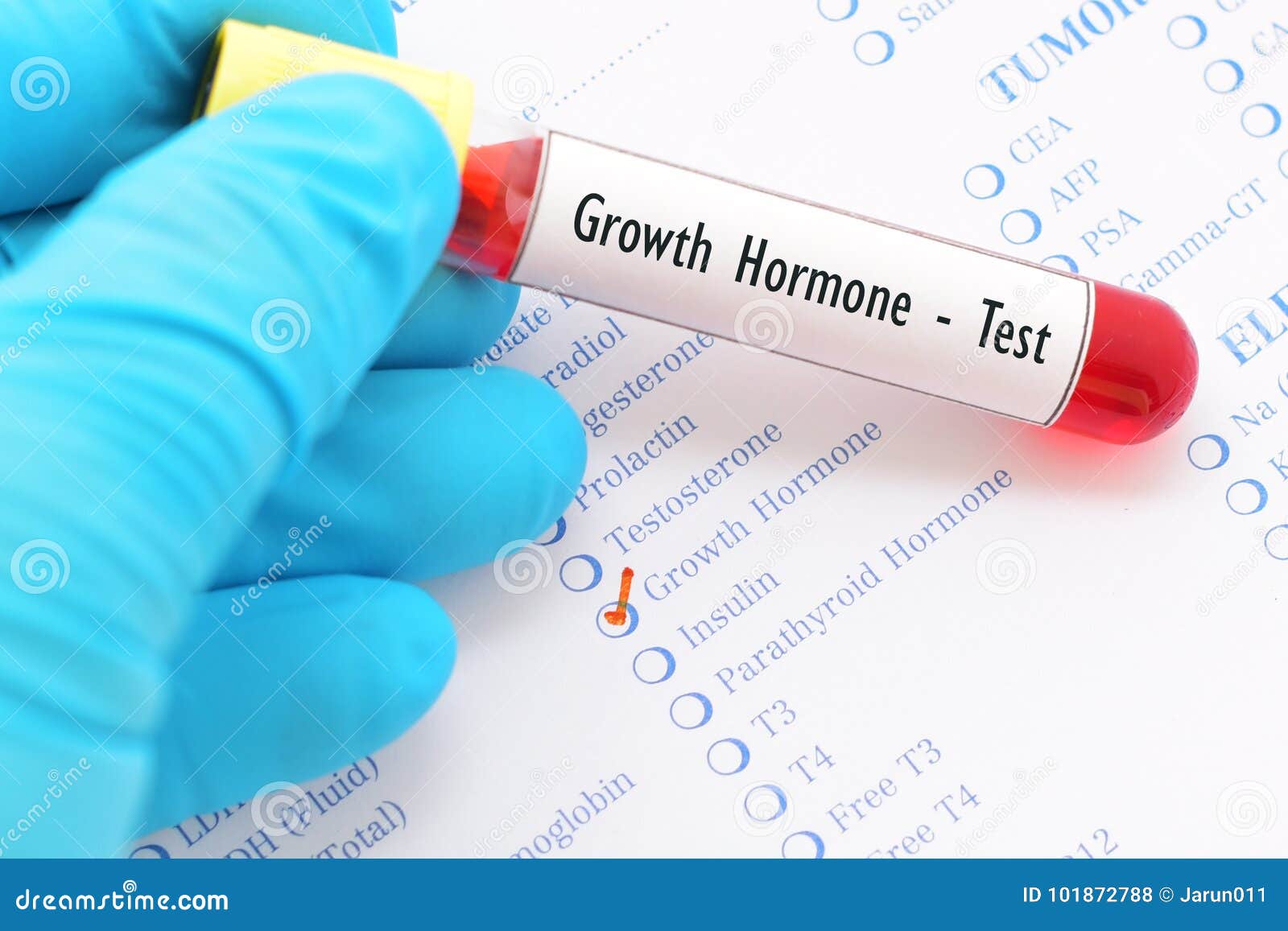 Prova Dell'ormone Della Crescita Fotografia Stock - Immagine di ...