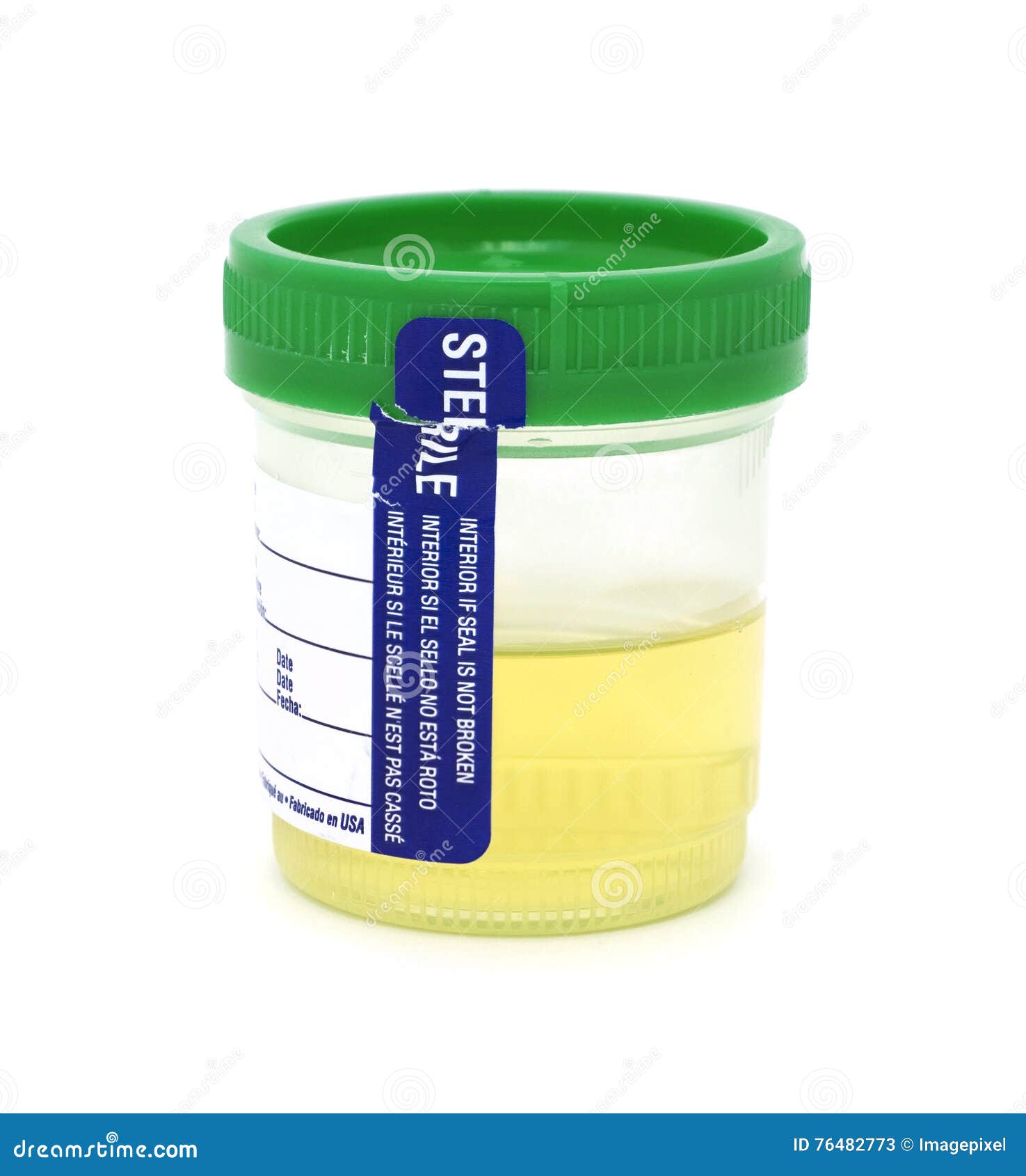 Prova Di Laboratorio Dell'urina Immagine Stock - Immagine di sterile ...