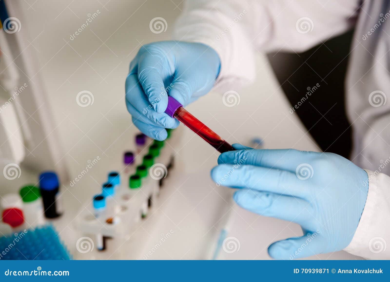 Provetta con anima immagine stock. Immagine di scienziato - 70939871