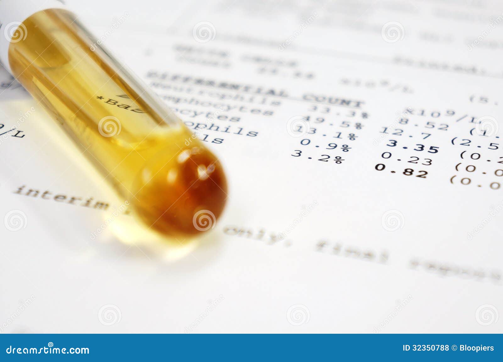 Provetta con i risultati fotografia stock. Immagine di plastica - 32350788