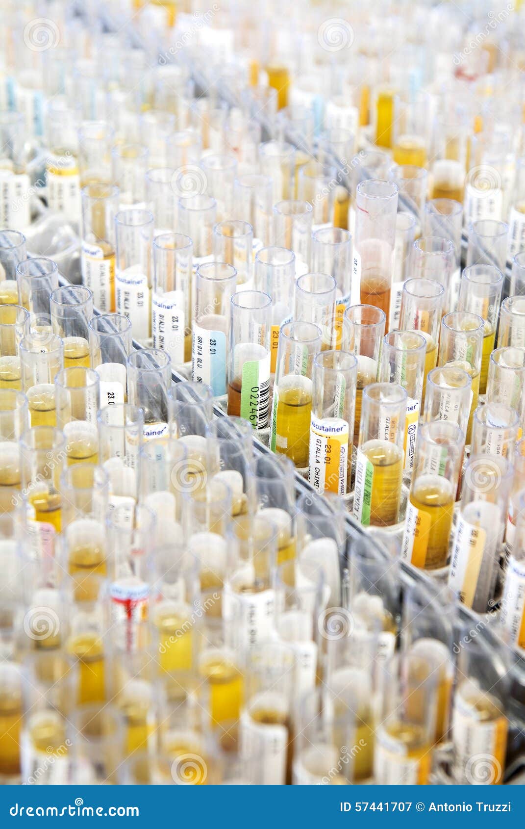 Provette Per Analisi Di Urina in Laboratorio Immagine Stock - Immagine ...