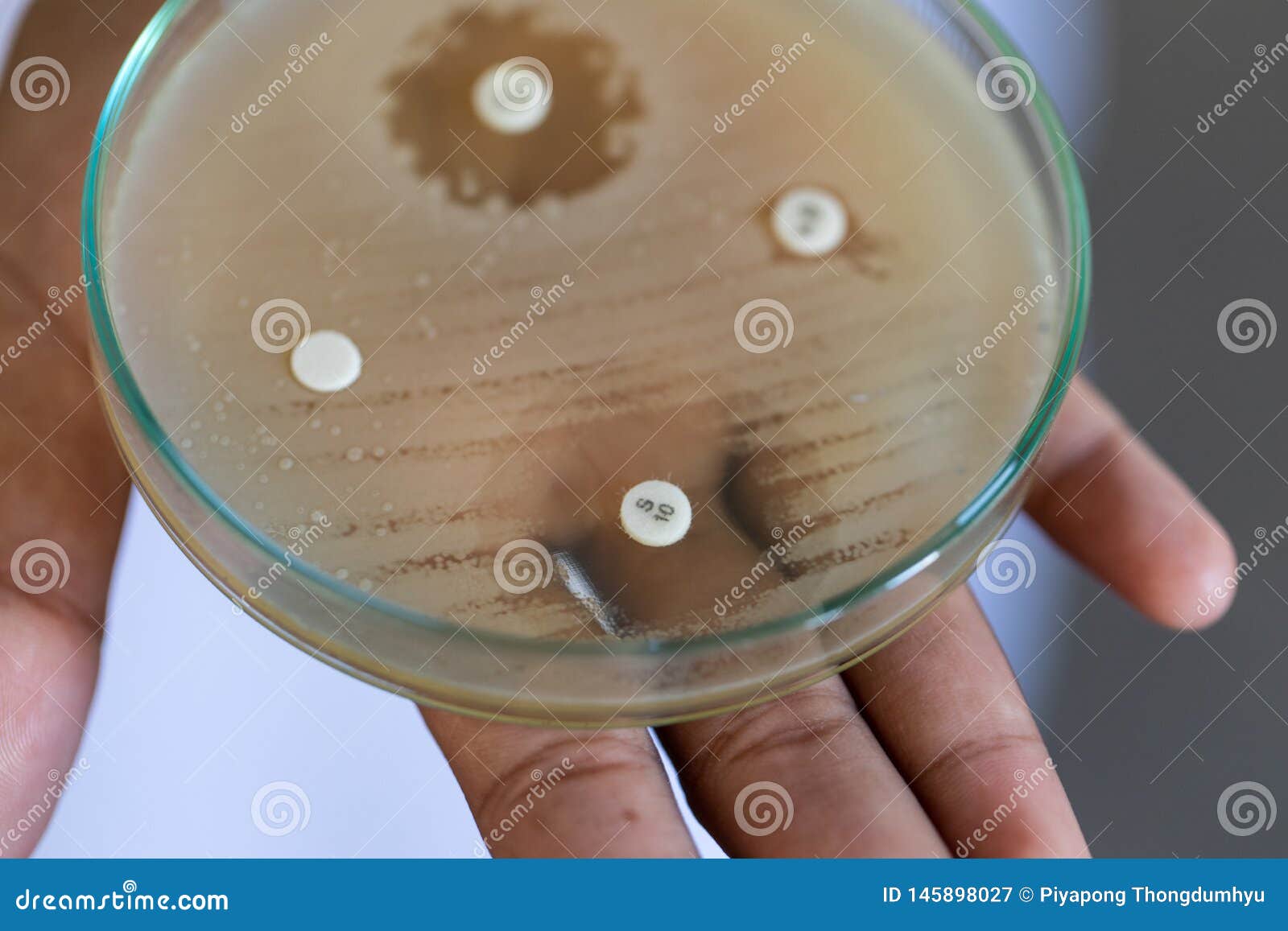 Prueba De La Droga De La Microbiolog?a Imagen de archivo - Imagen de fondo, agar: 145898027