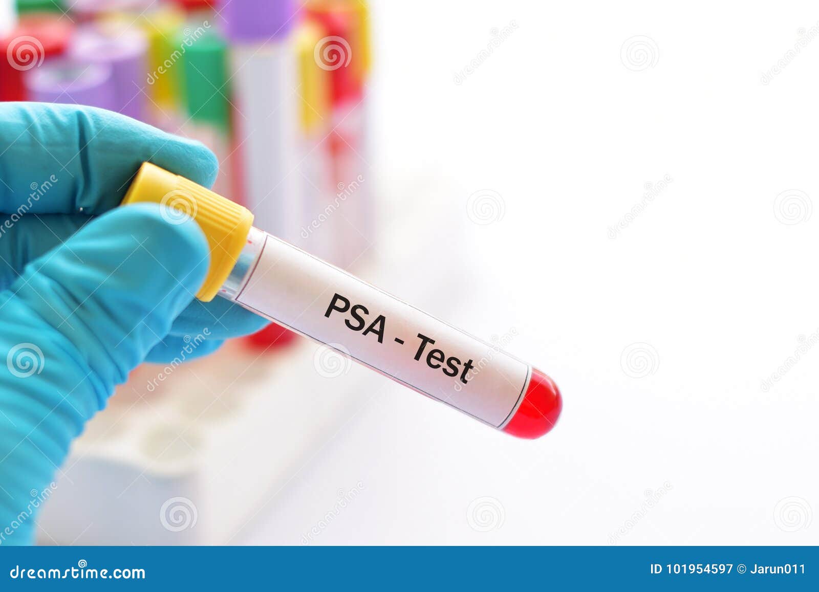 Prueba del PSA imagen de archivo. Imagen de hospital - 101954597