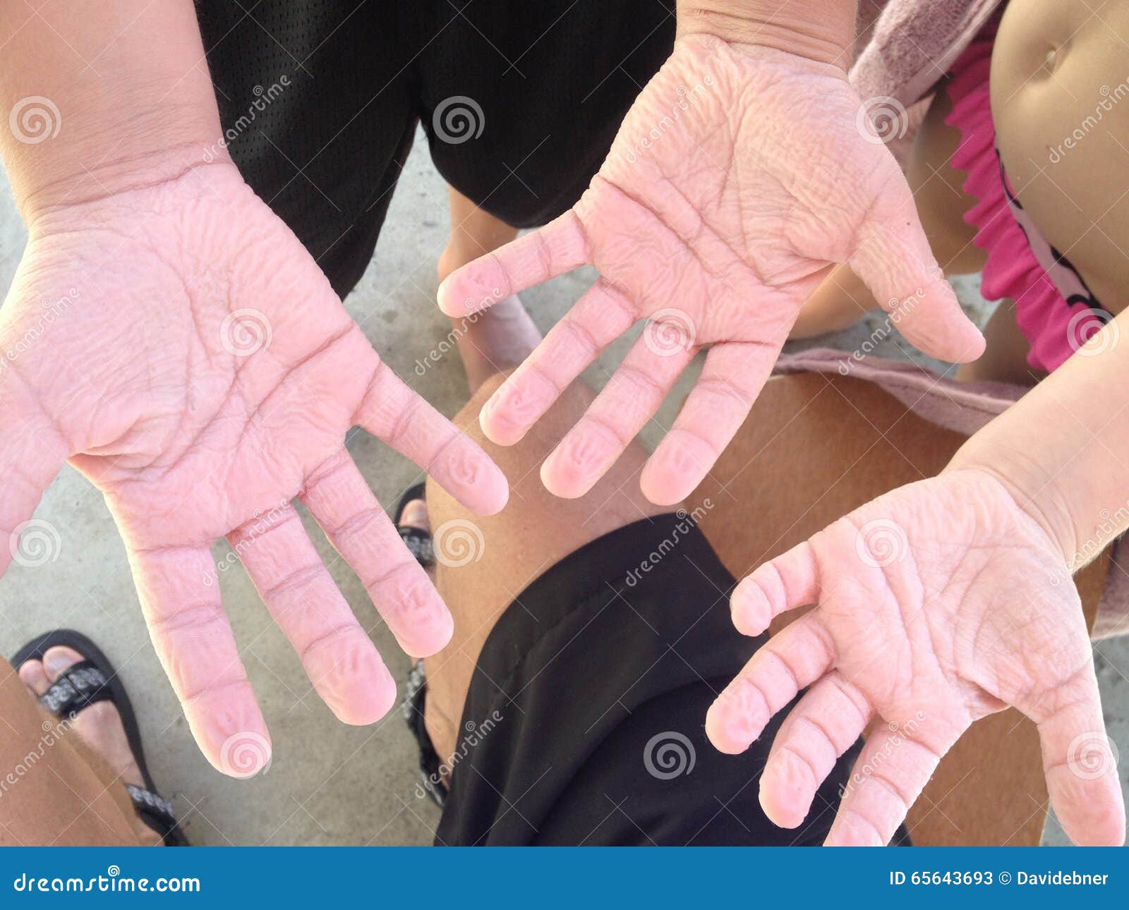 Pruned Hands stock image. Image of young, hands, wrinkles - 65643693