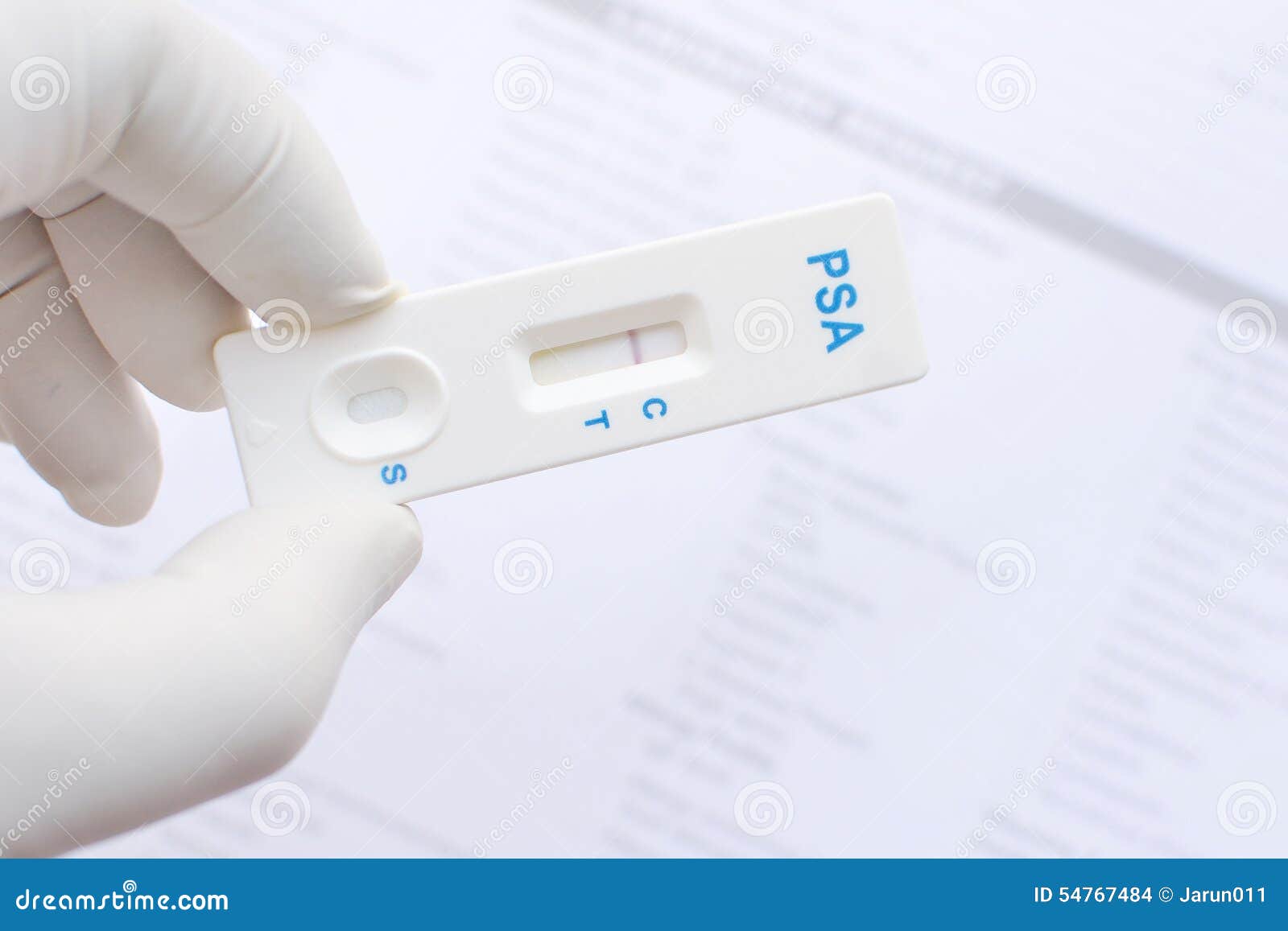 PSA negative stock photo. Image of analyzing, biology - 54767484