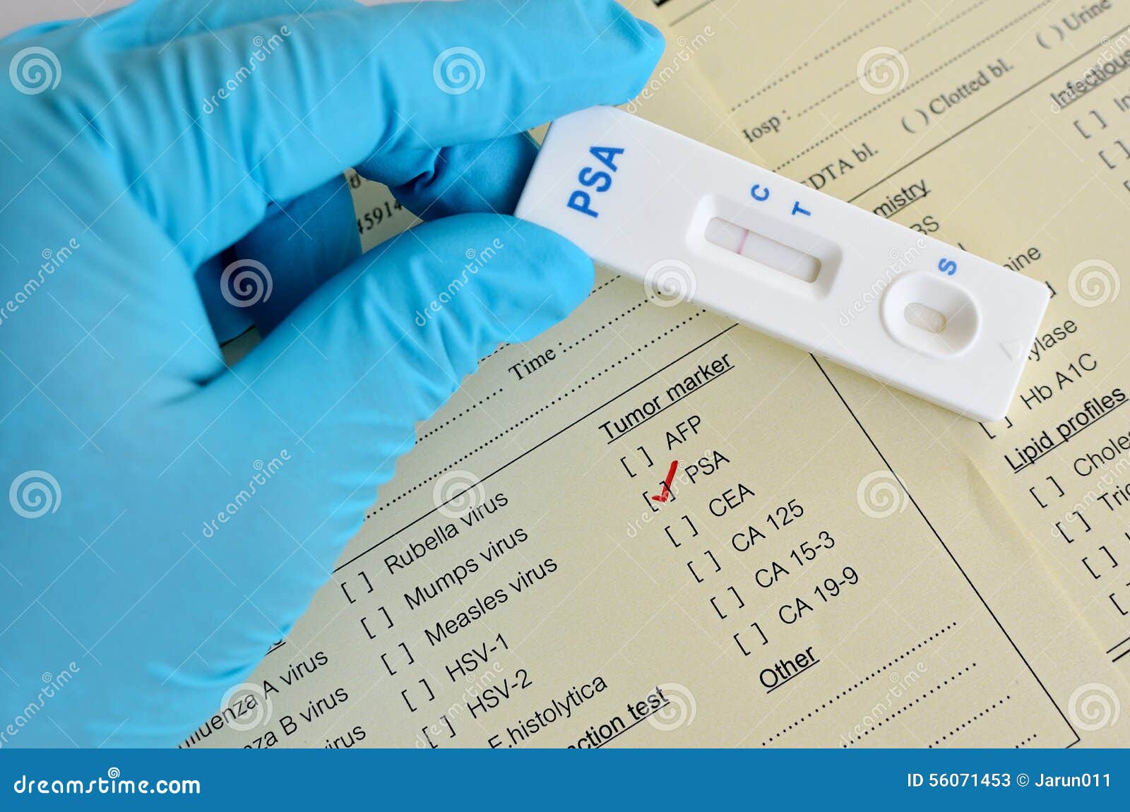 PSA negative stock image. Image of healthcare, hospital - 56071453