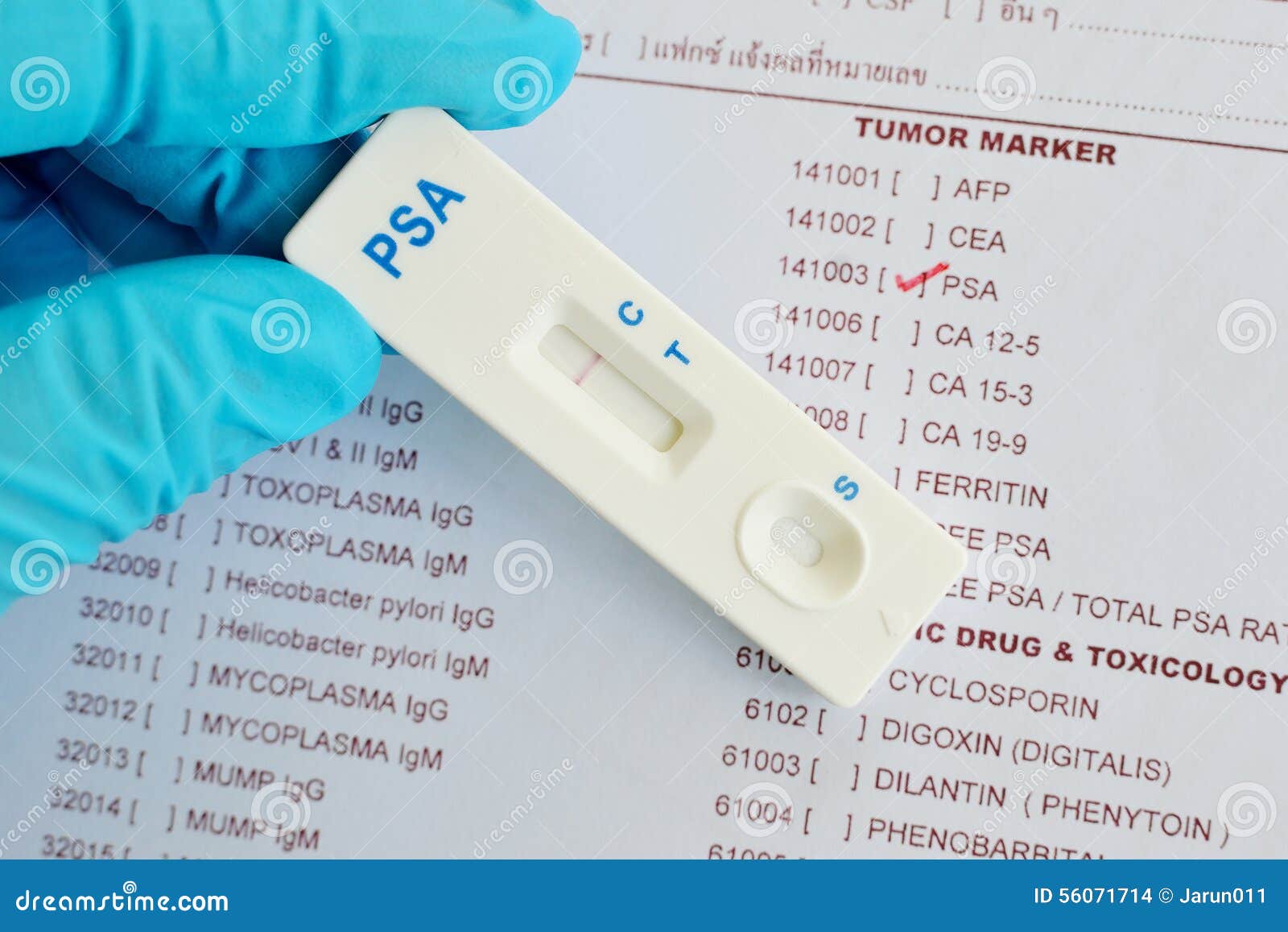 PSA negative stock photo. Image of healthcare, science - 56071714