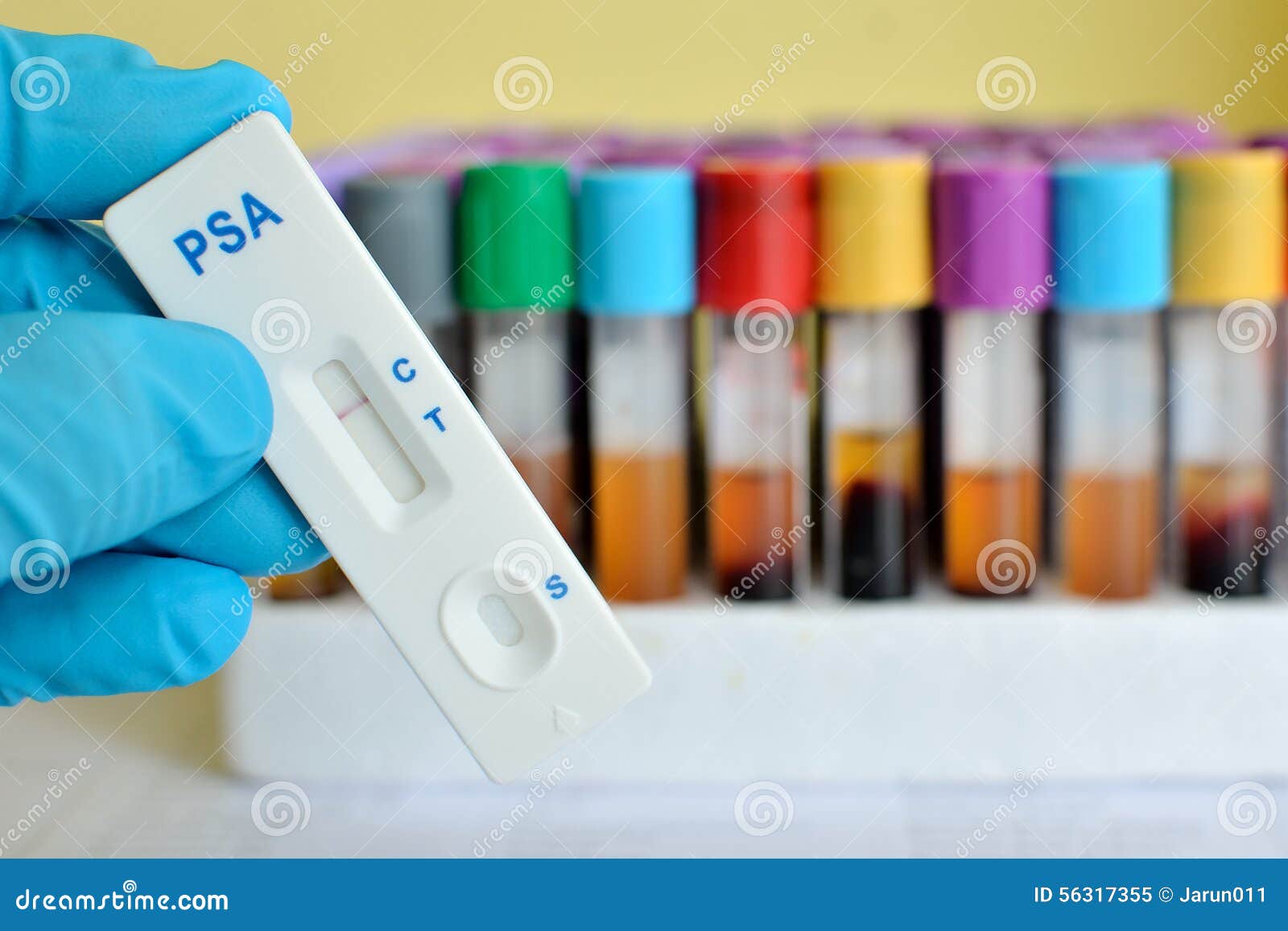 PSA negative stock image. Image of healthcare, exam, immunology - 56317355