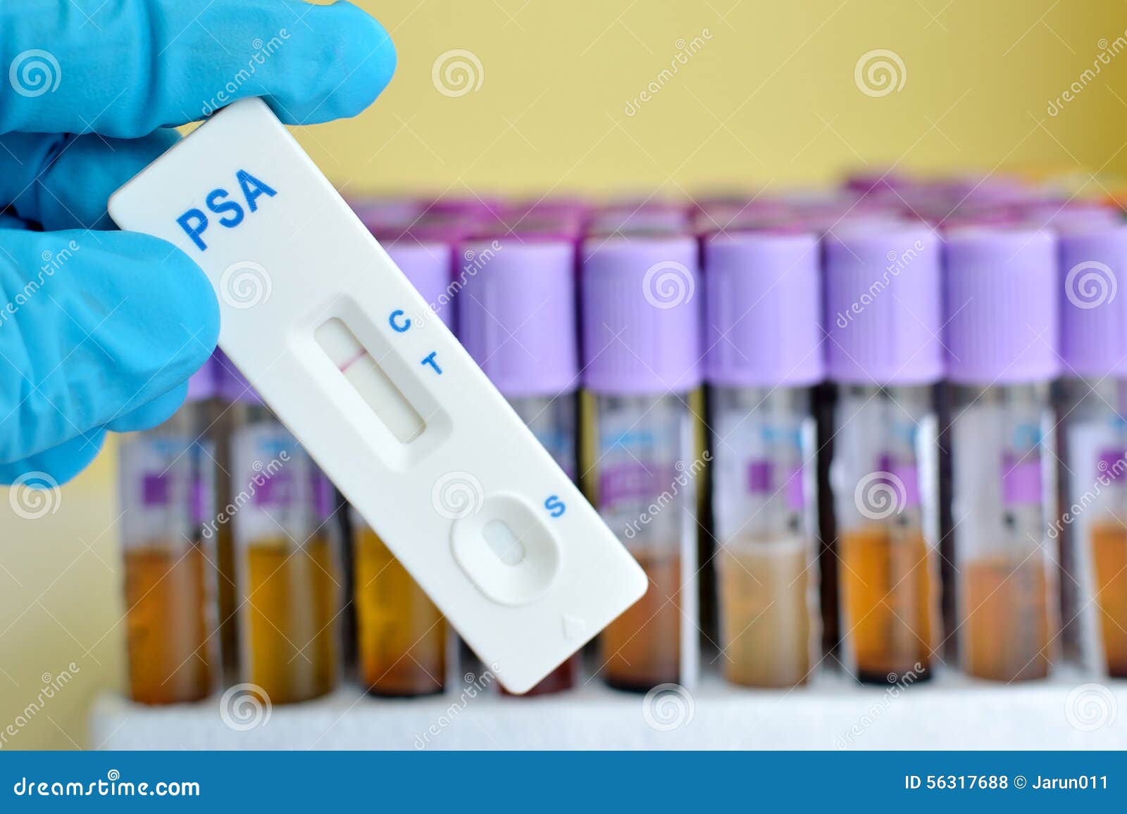PSA negative stock photo. Image of prostate, tube, laboratory - 56317688