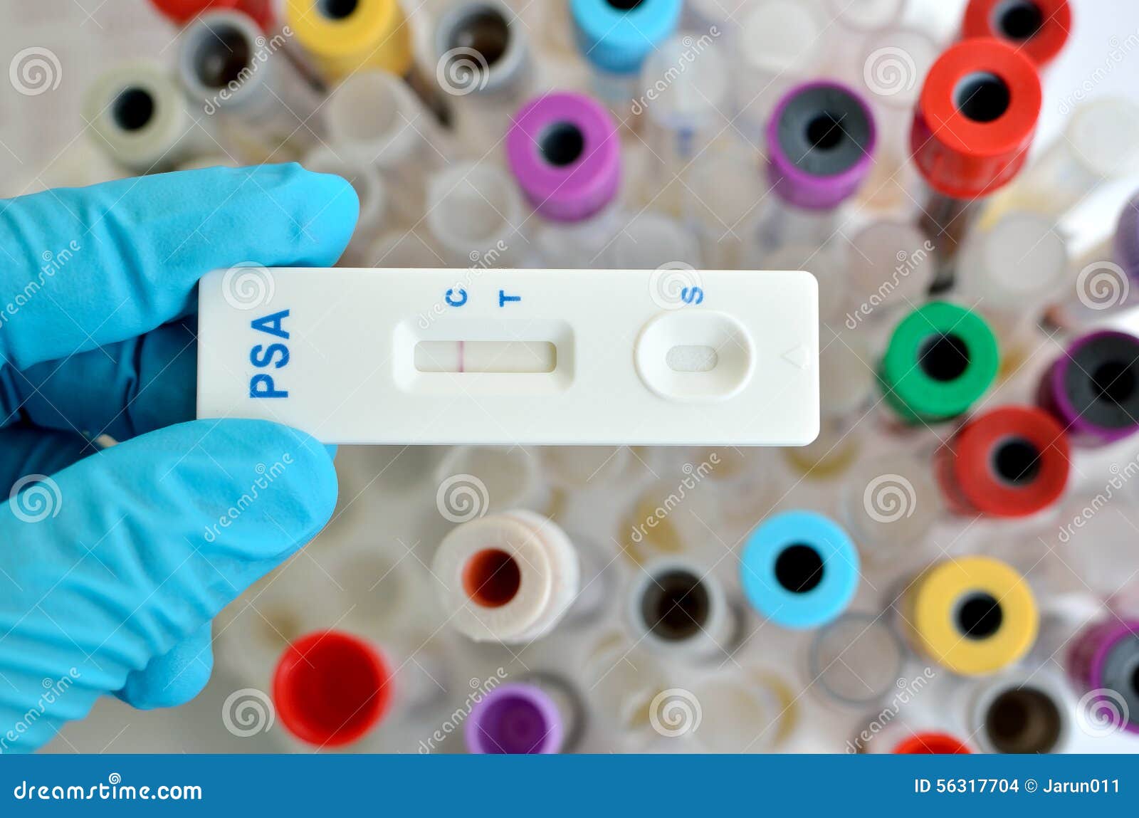 PSA negative stock photo. Image of hematology, scientific - 56317704