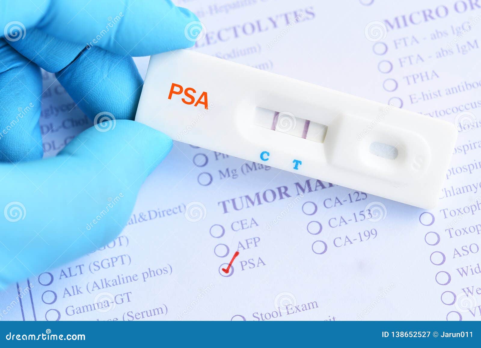 PSA positive test result stock image. Image of medical - 138652527