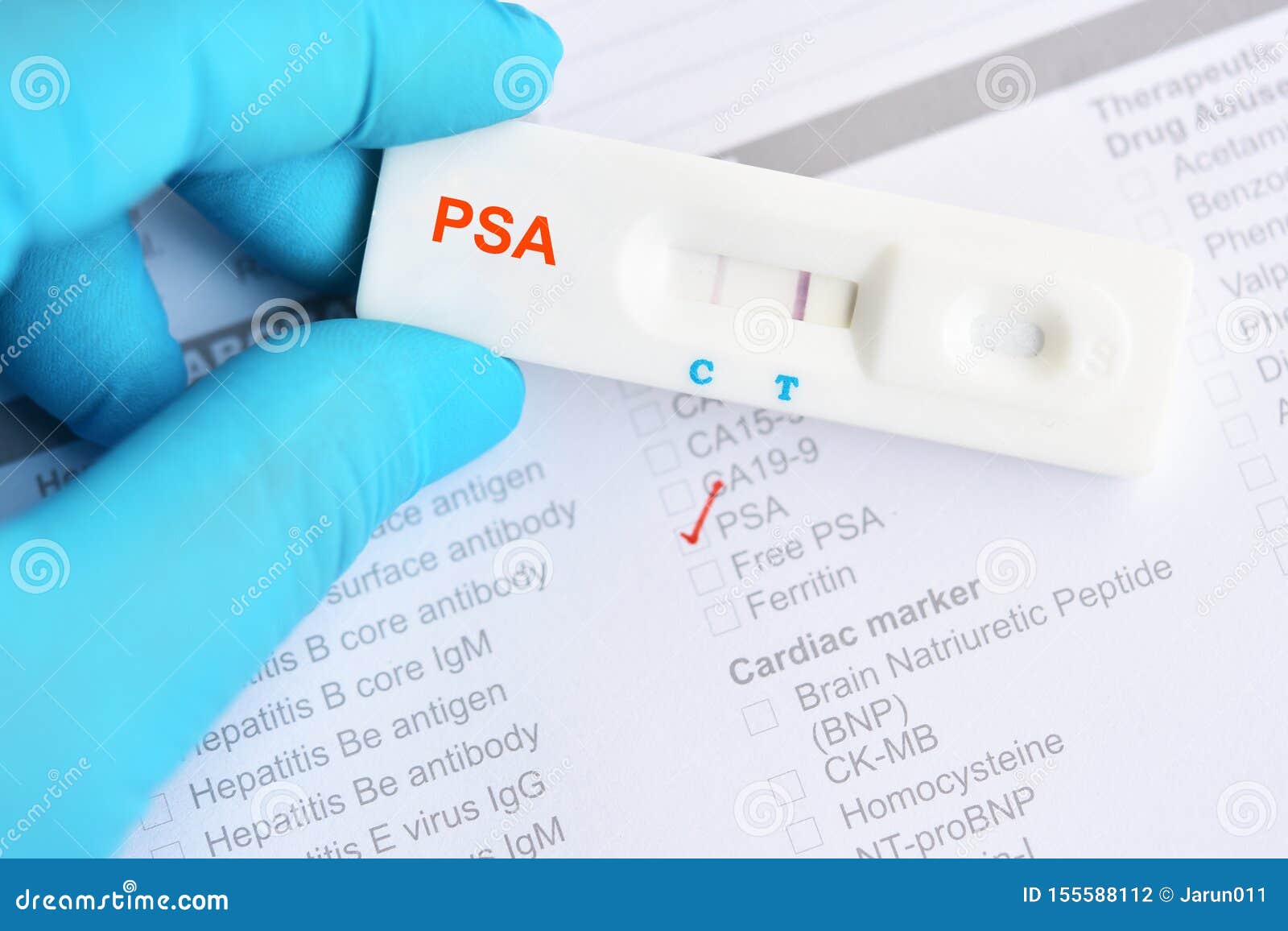 PSA positive test result stock photo. Image of aged - 155588112