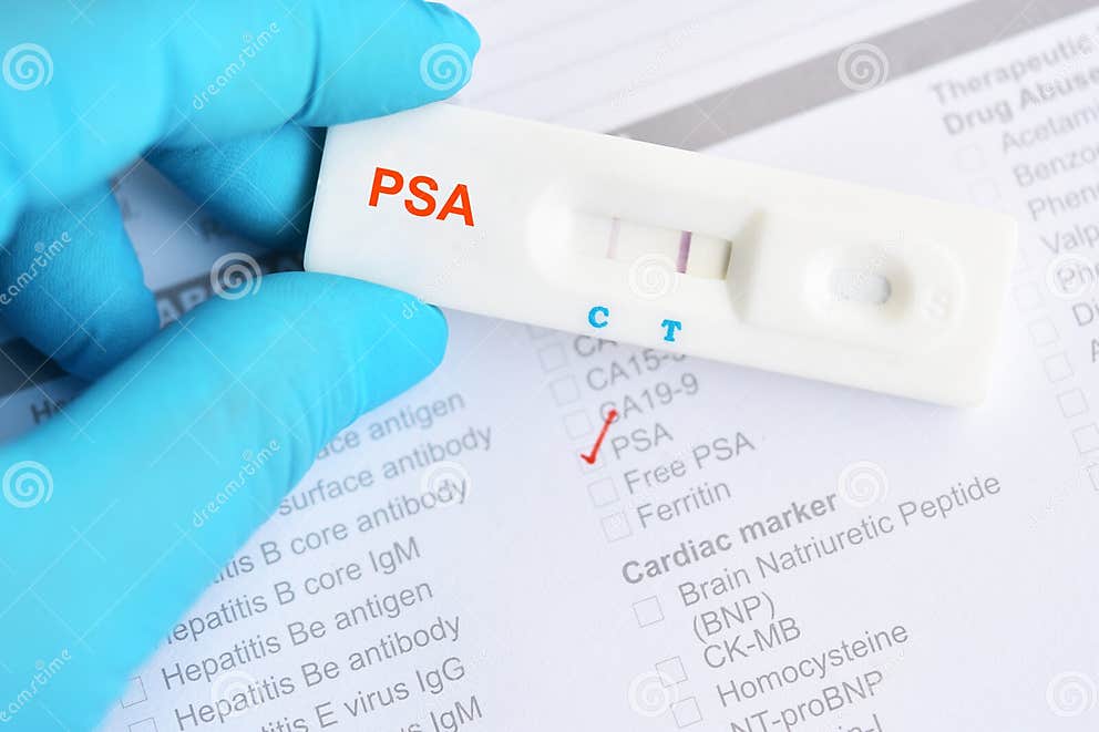PSA positive test result stock photo. Image of aged - 155588112