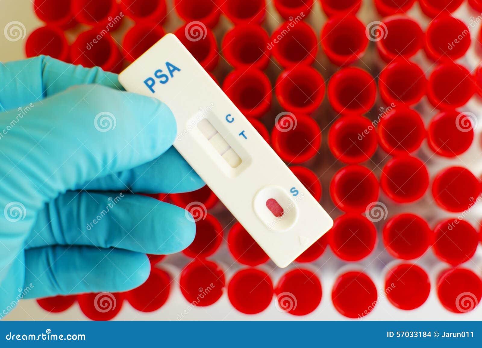 PSA positive stock photo. Image of test, tumor, medical - 57033184