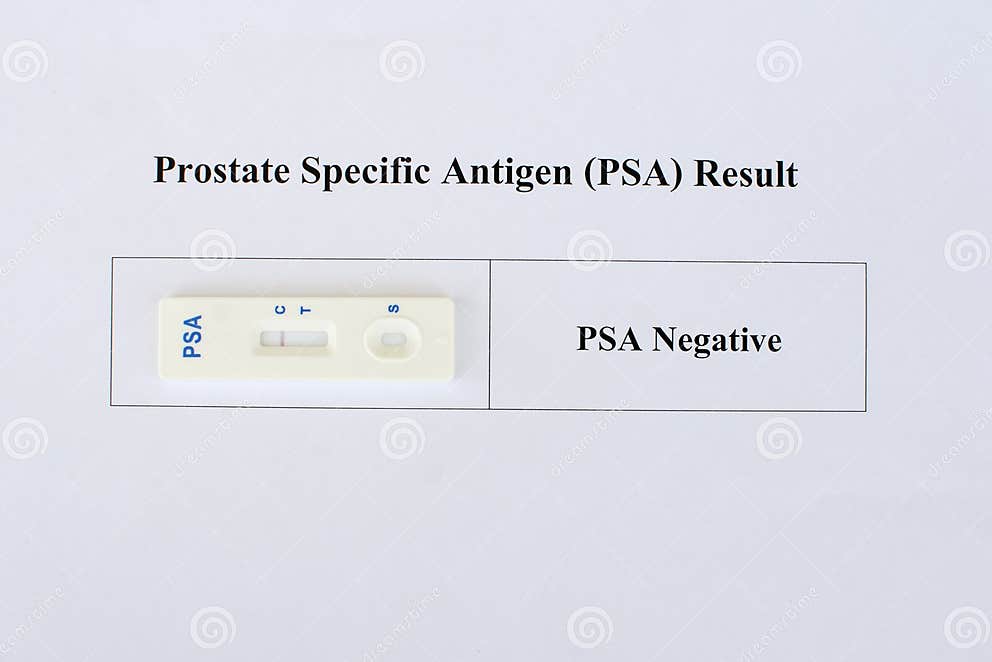 PSA result negative stock photo. Image of marker, disease - 60254794