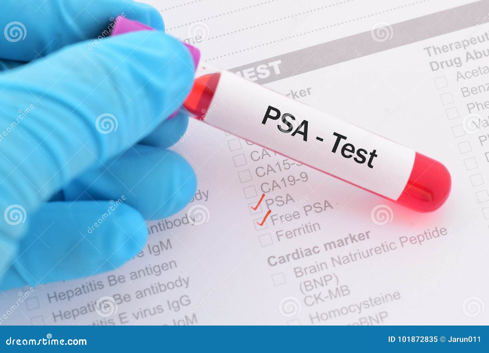 PSA Test stock afbeelding. Image of bejaarden, teller - 101872835