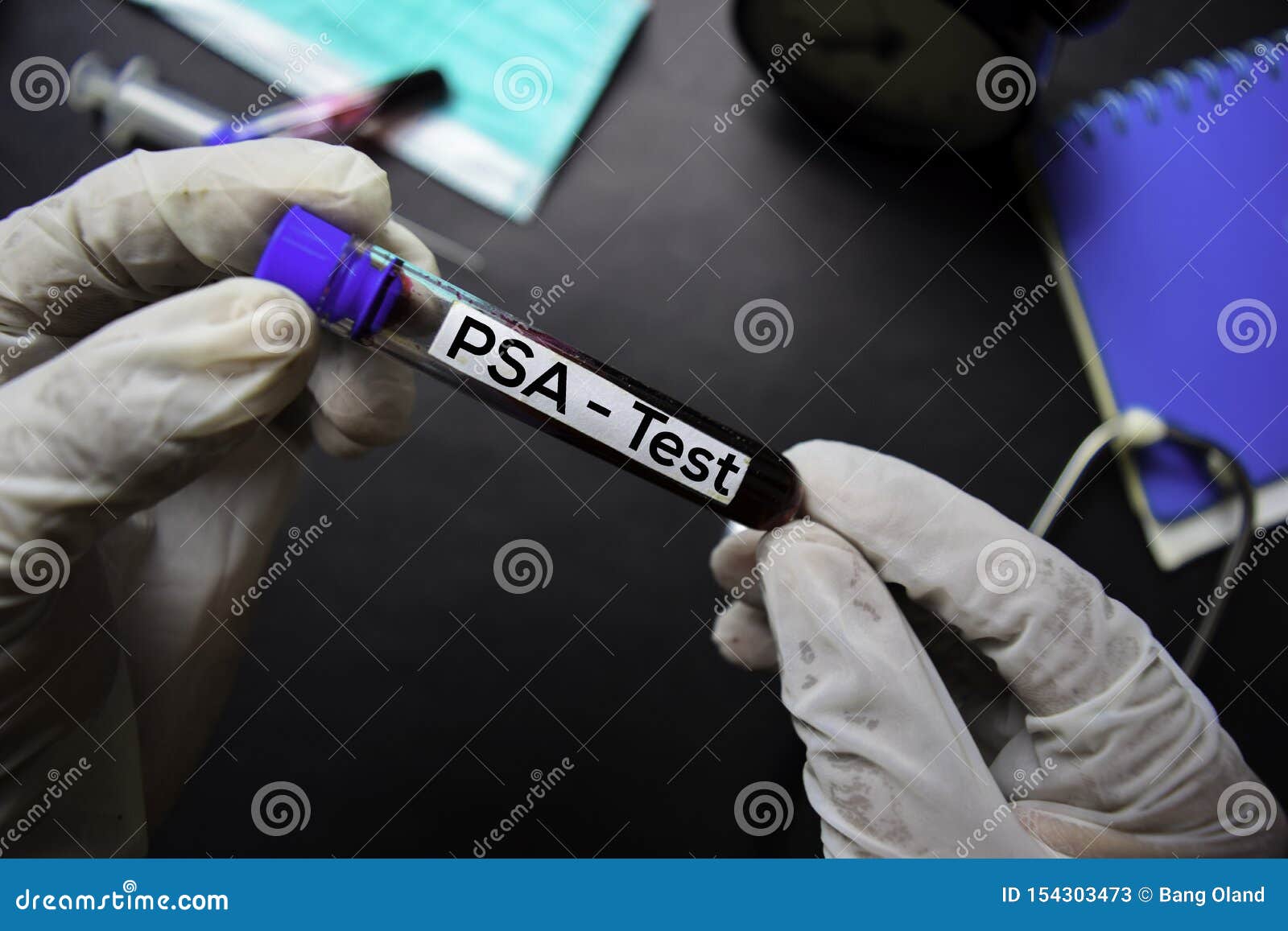 PSA - Test with Blood Sample. Top View Isolated on Black Background ...