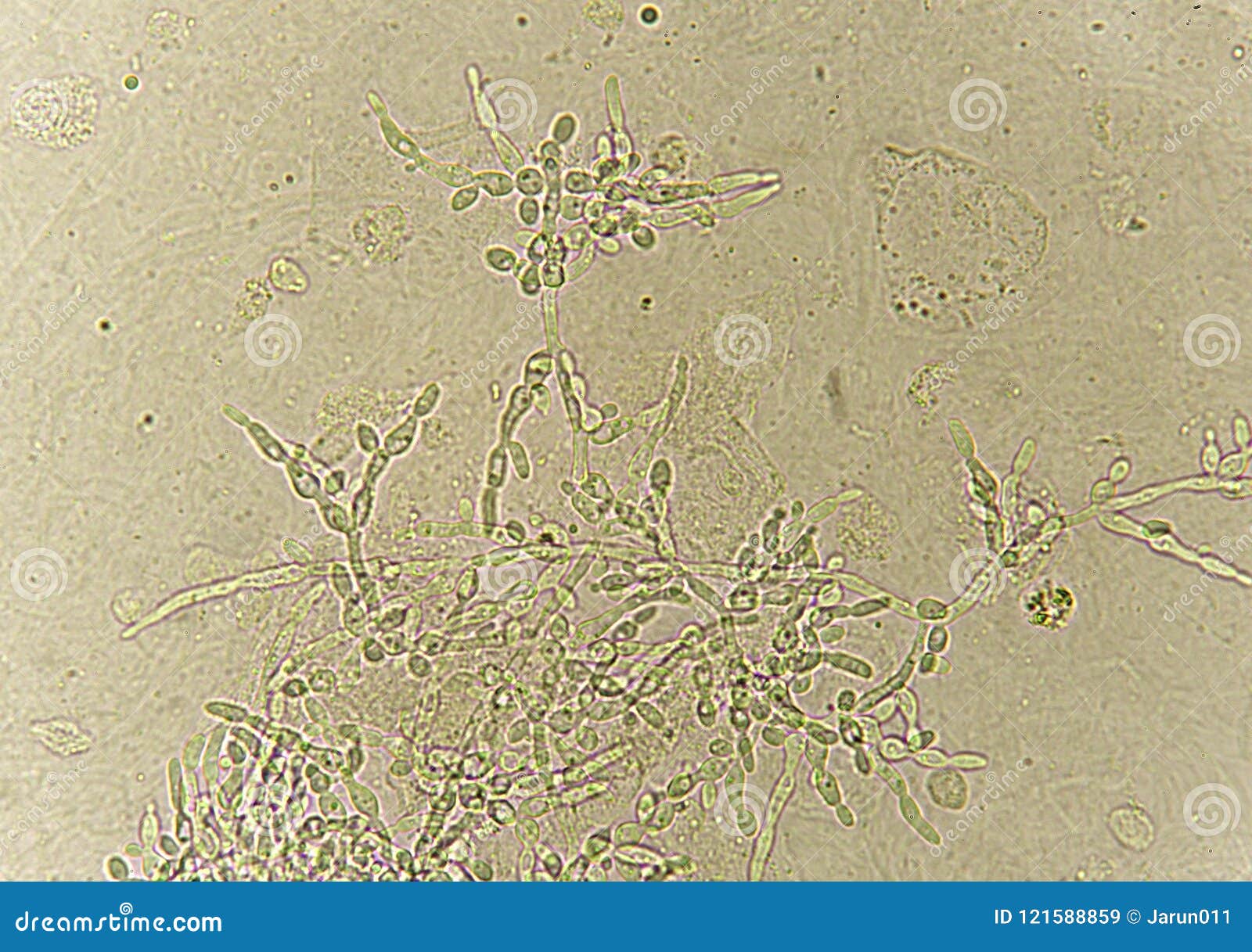 Yeast Cells In Urine MEDICAL LAB INFO