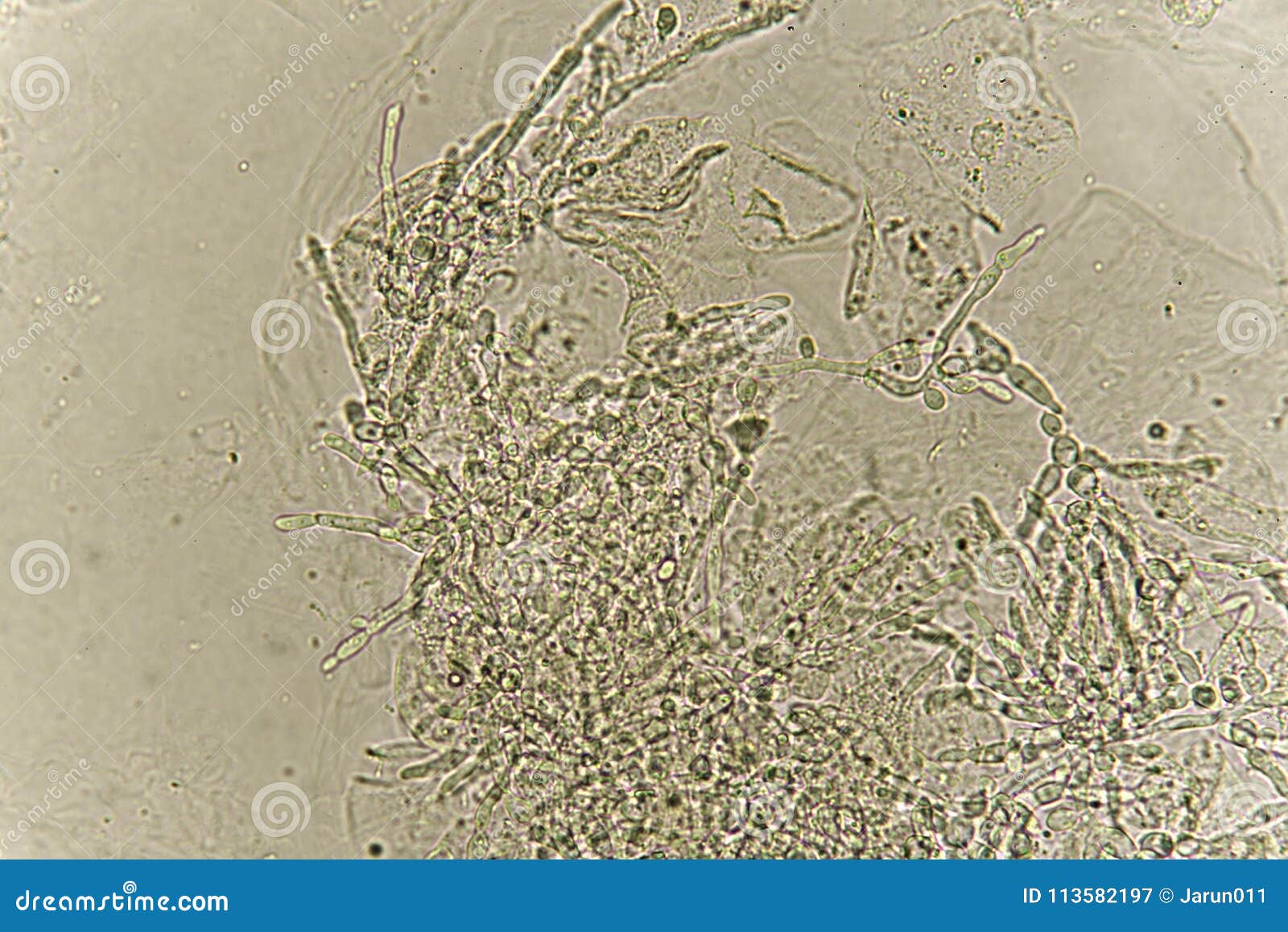 Pseudohyphae En Ontluikende Gistcellen in Urine Stock Afbeelding ...