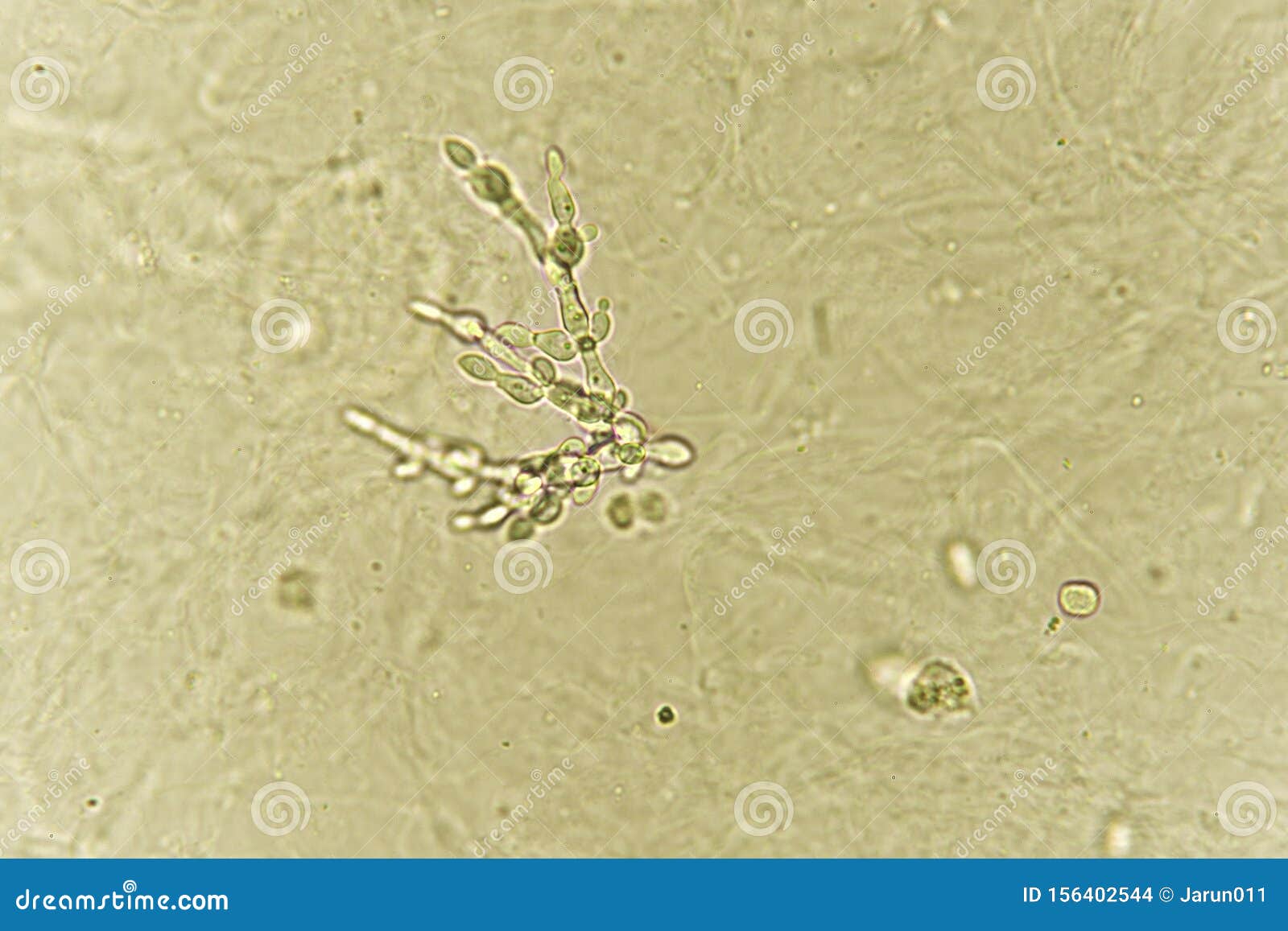 Pseudohyphae Und Anstehende Hefezellen Im Urin Stockfoto - Bild von ...