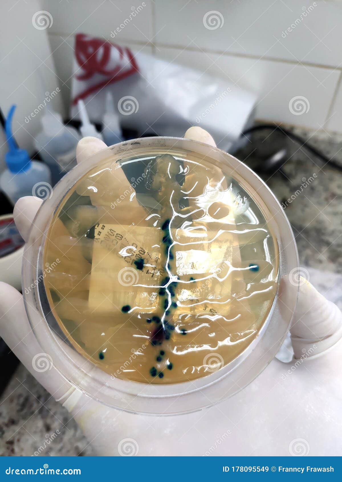 Pseudomonas Aeruginosa Bacteria On On Columbia Blood Agar Stock Photo ... Pseudomonas Aeruginosa Bacteria On On Columbia Blood Agar Stock Photo ...