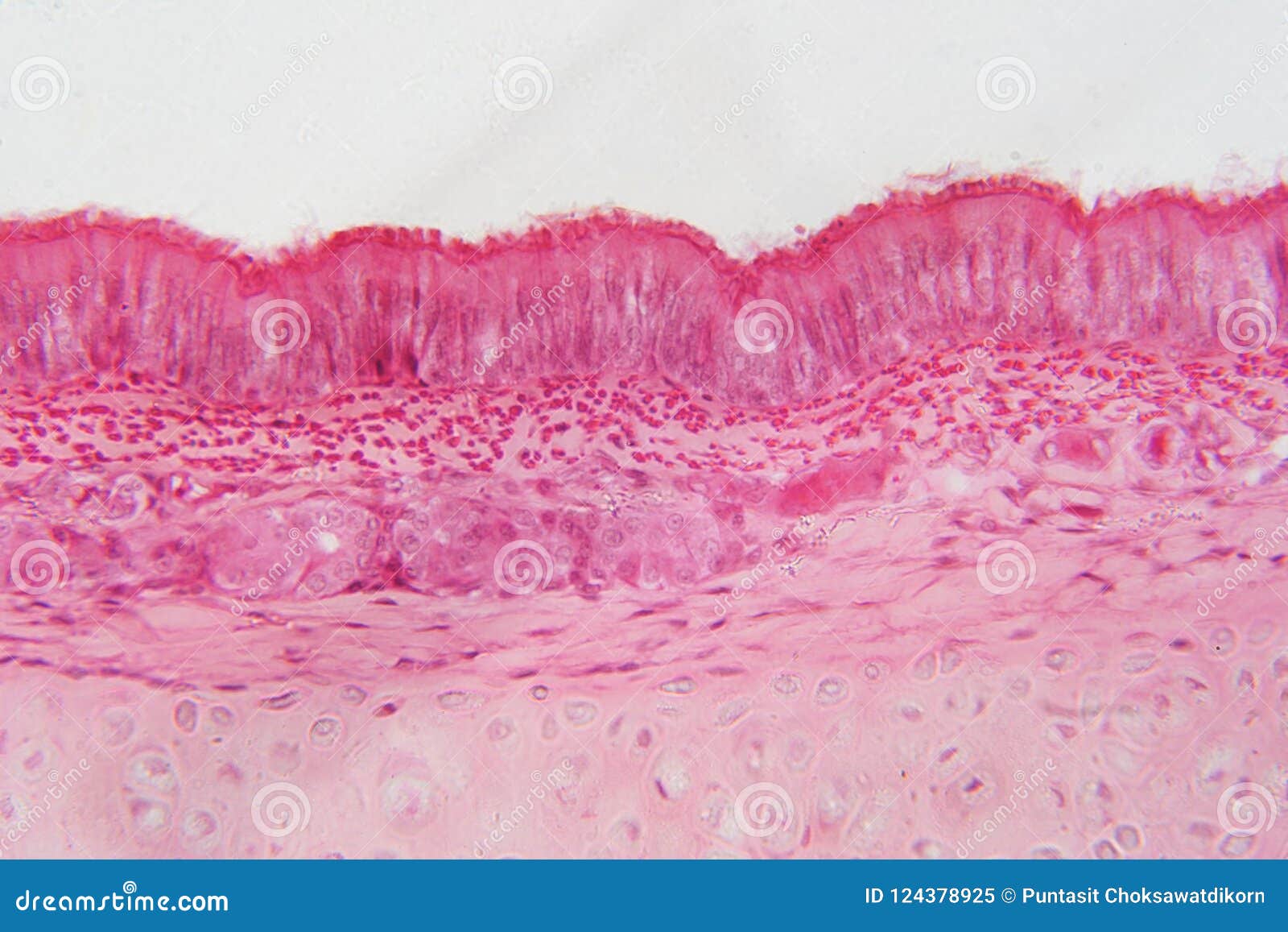 Pseudostratified Epithelial Tissue