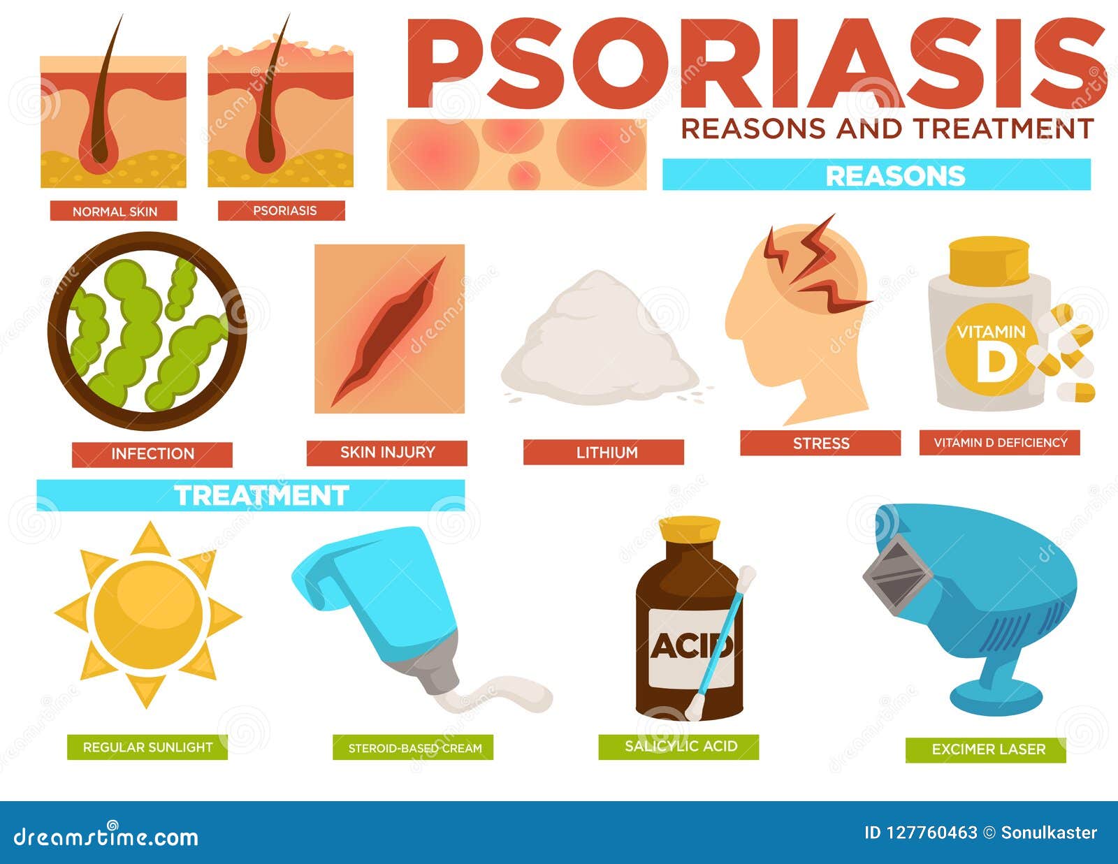 Psoriasis Reasons And Treatment Poster With Info Vector Stock Vector