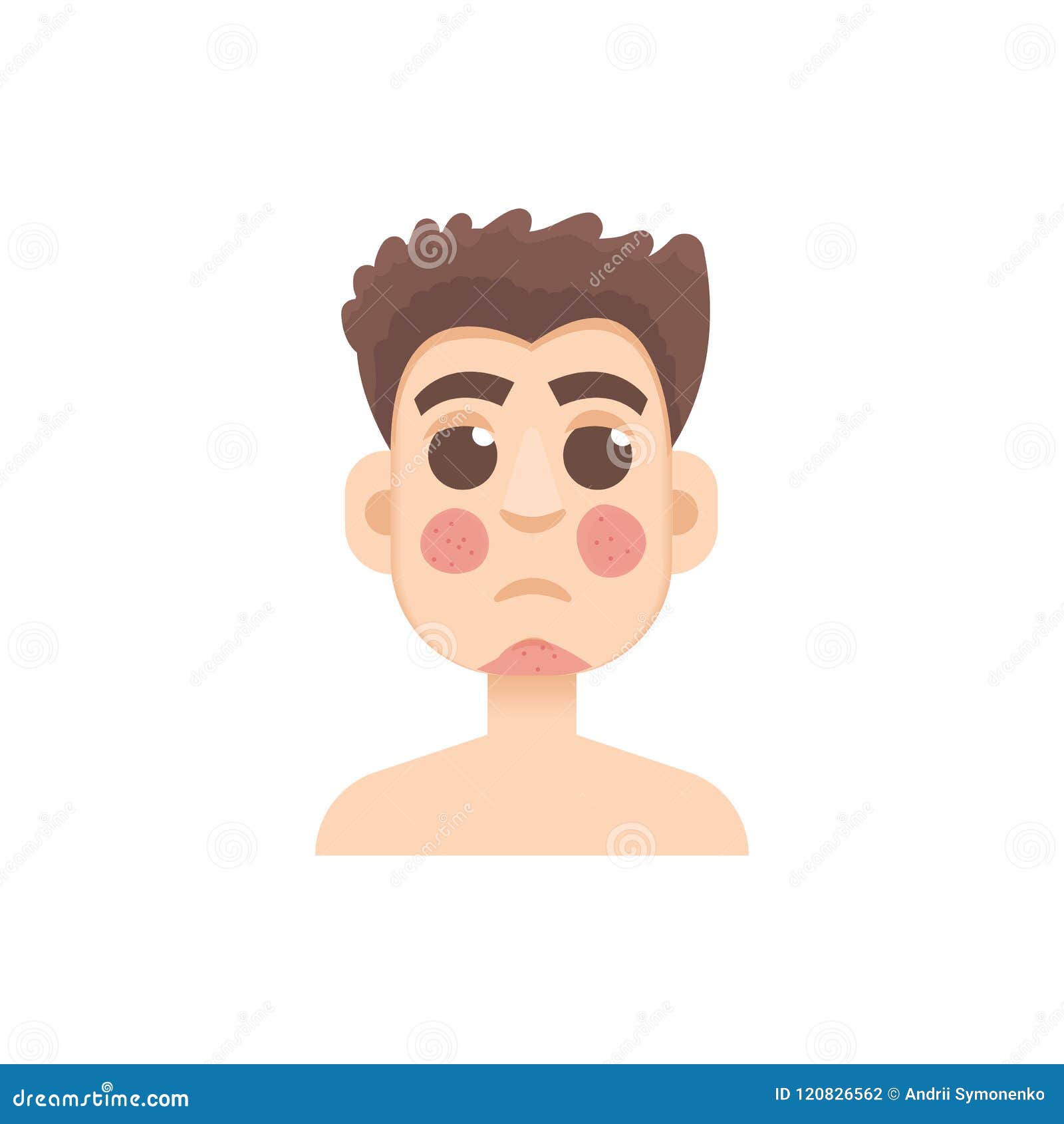 Psoriasis or Rosacea Men Face. Stock Vector - Illustration of loop ...