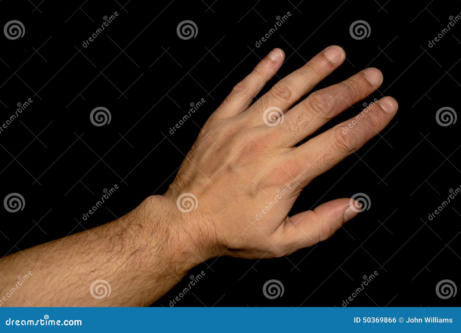 Psoriasis sur des doigts photo stock. Image du abstrait - 50369866